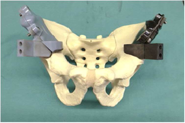 [Translated article] Significant improvement in axial load stability ...