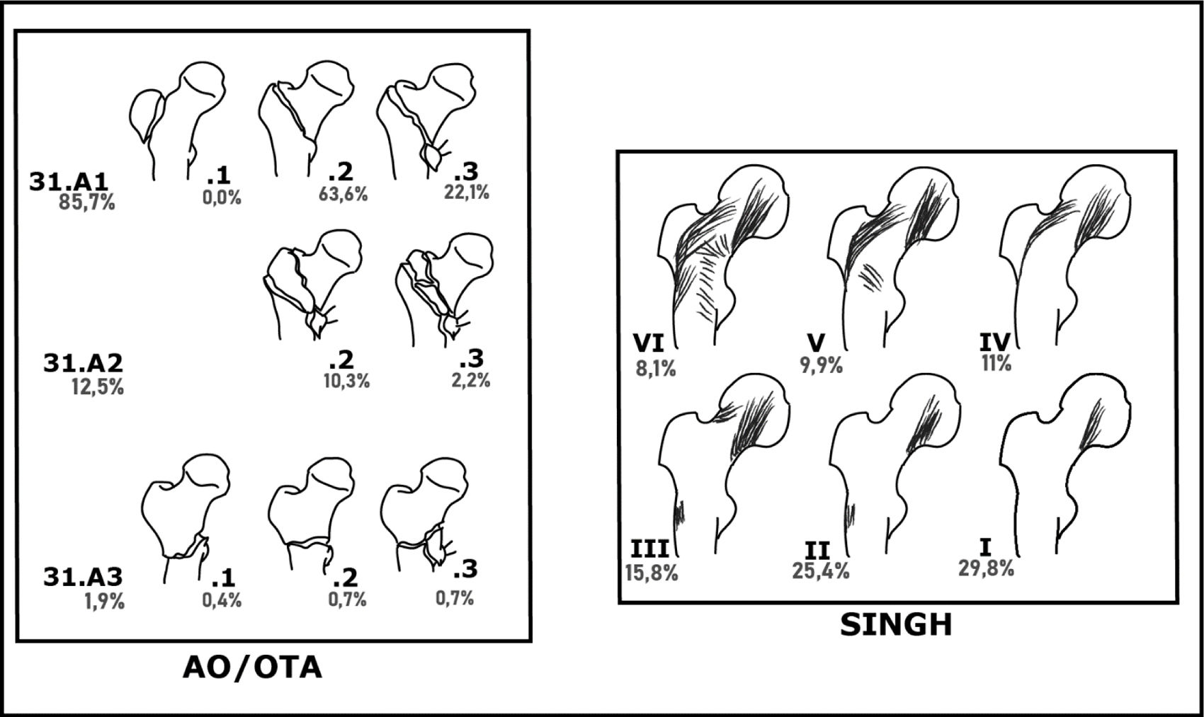 Nailing intertrochanteric fractures in geriatric population: Do we know ...