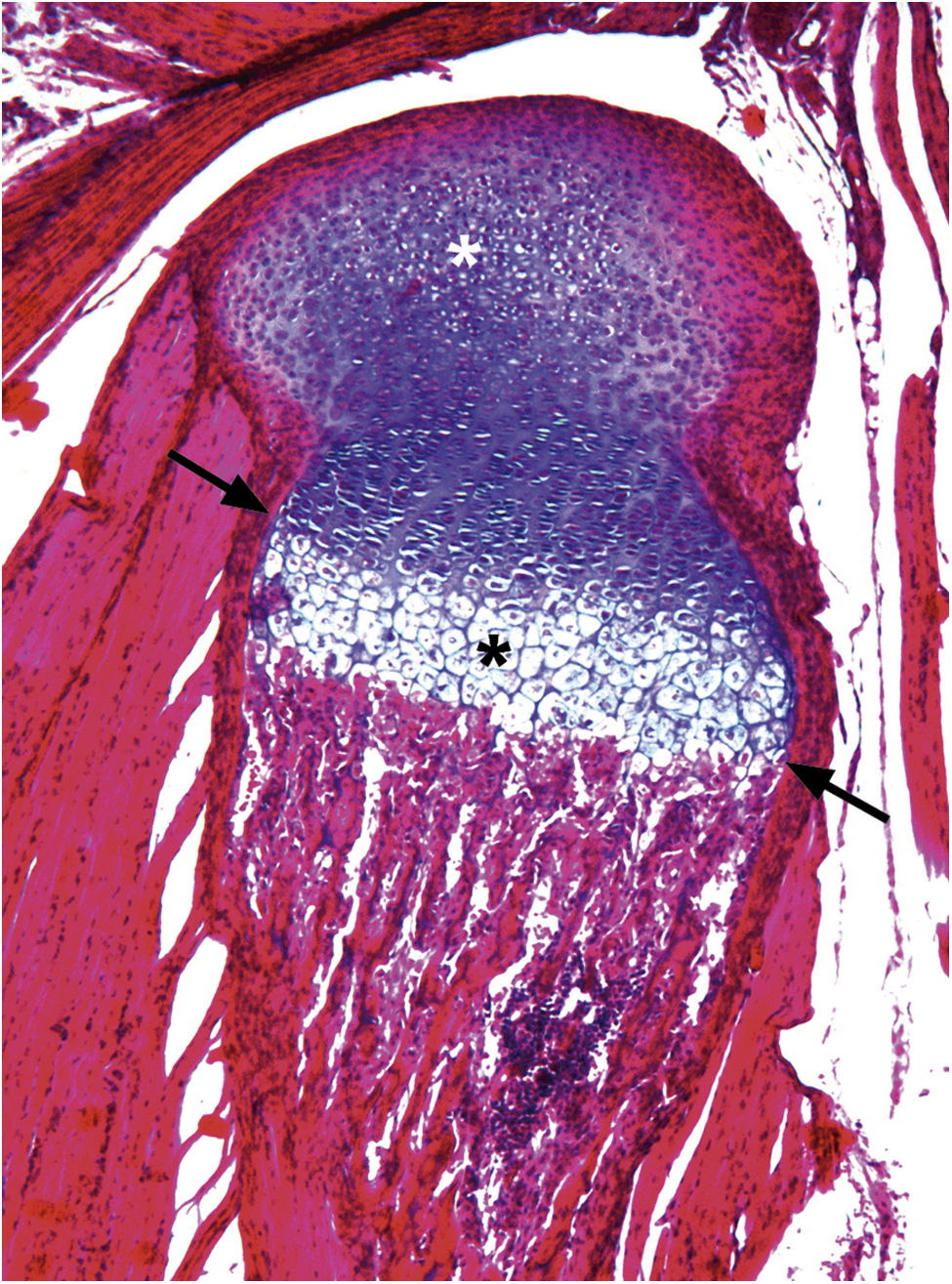 Ramón y Cajal and the cartilaginous growth plate | Revista Española de ...