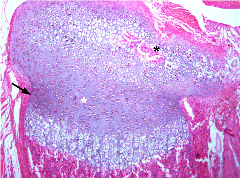 Ramón y Cajal and the cartilaginous growth plate | Revista Española de ...
