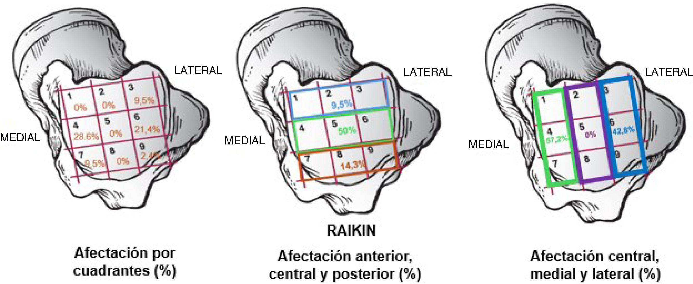 Estudio piloto para evaluar la relación entre el tipo, la ubicación y ...