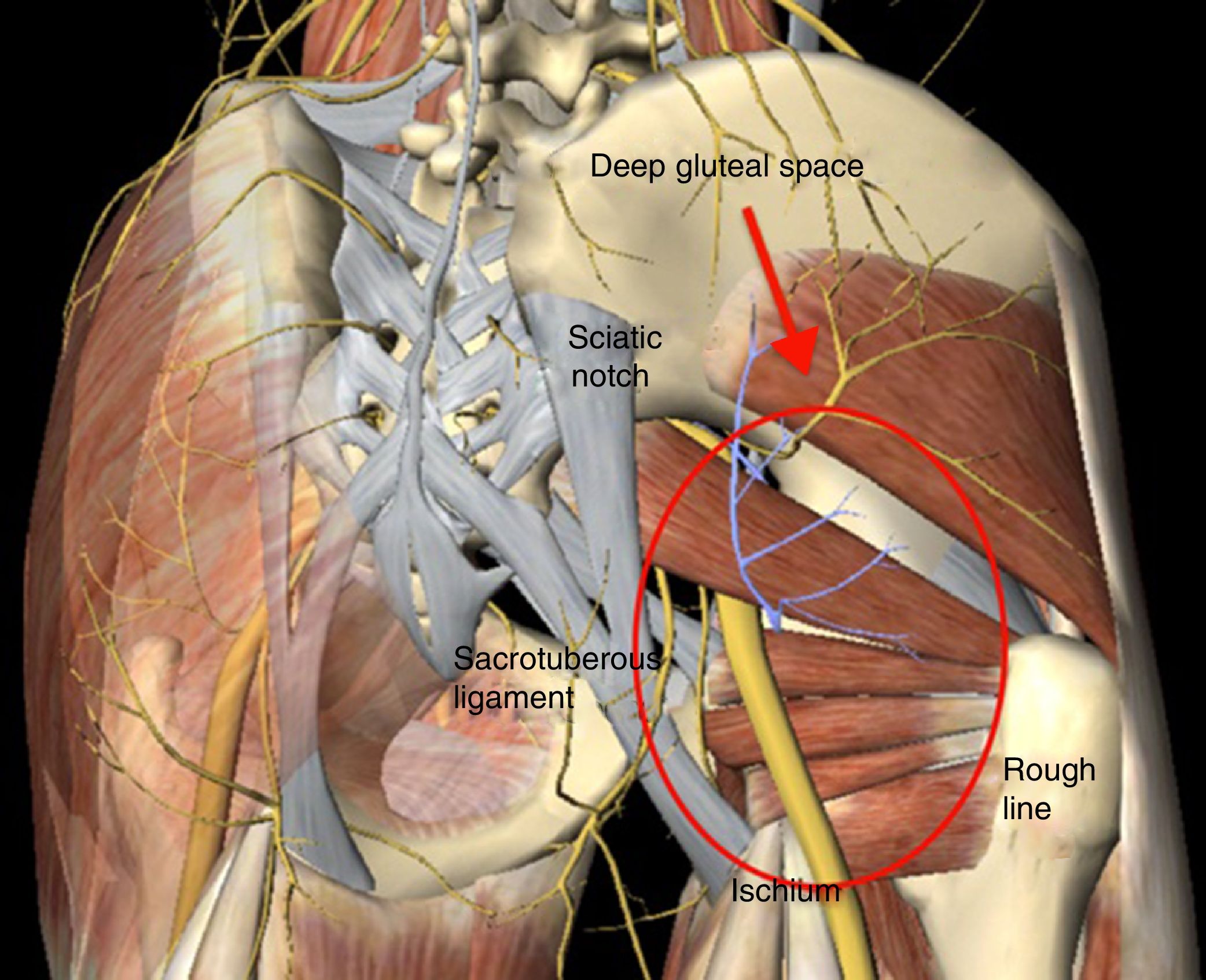 sciatic notch palpation