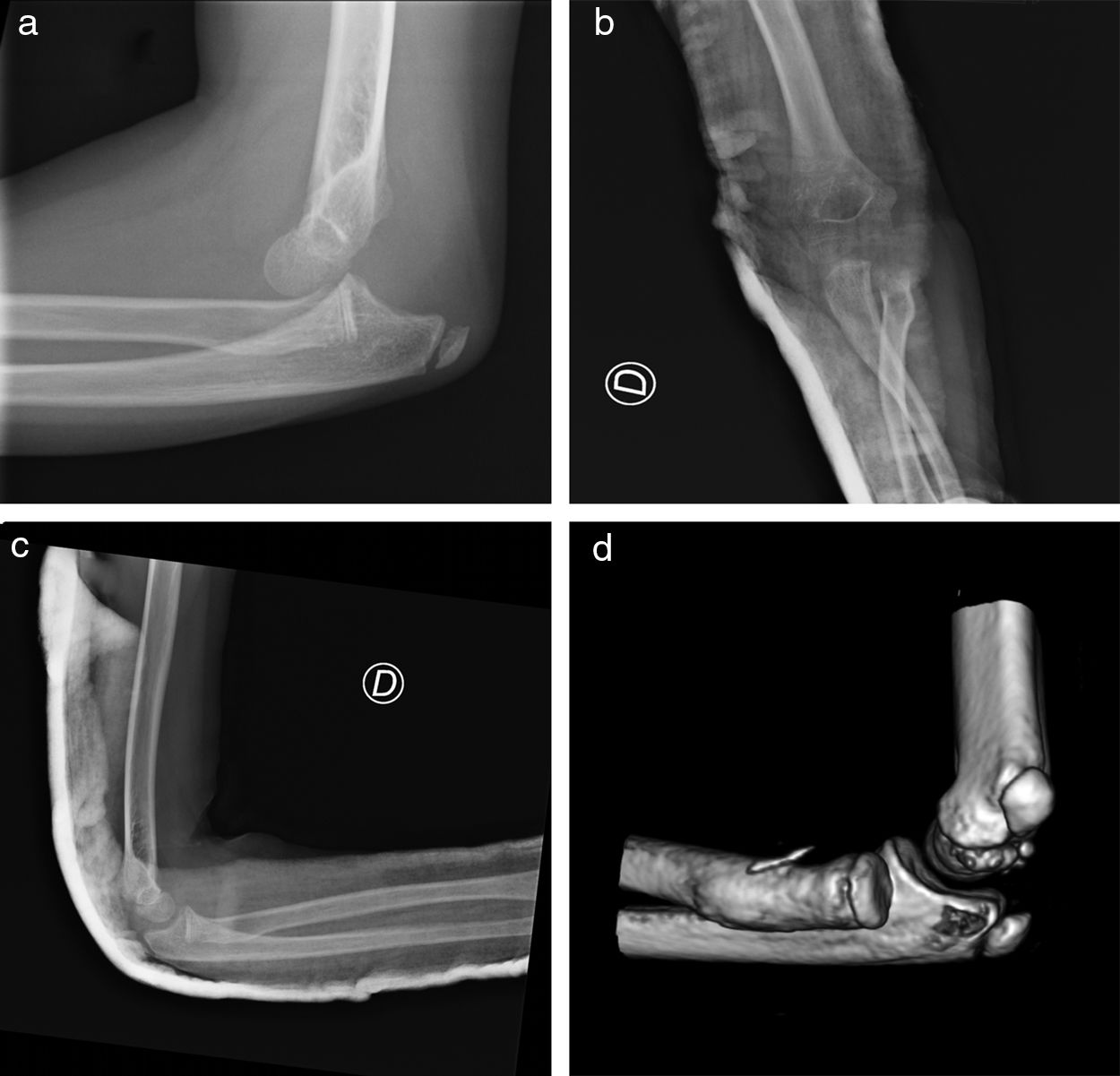 dislocated elbow cat