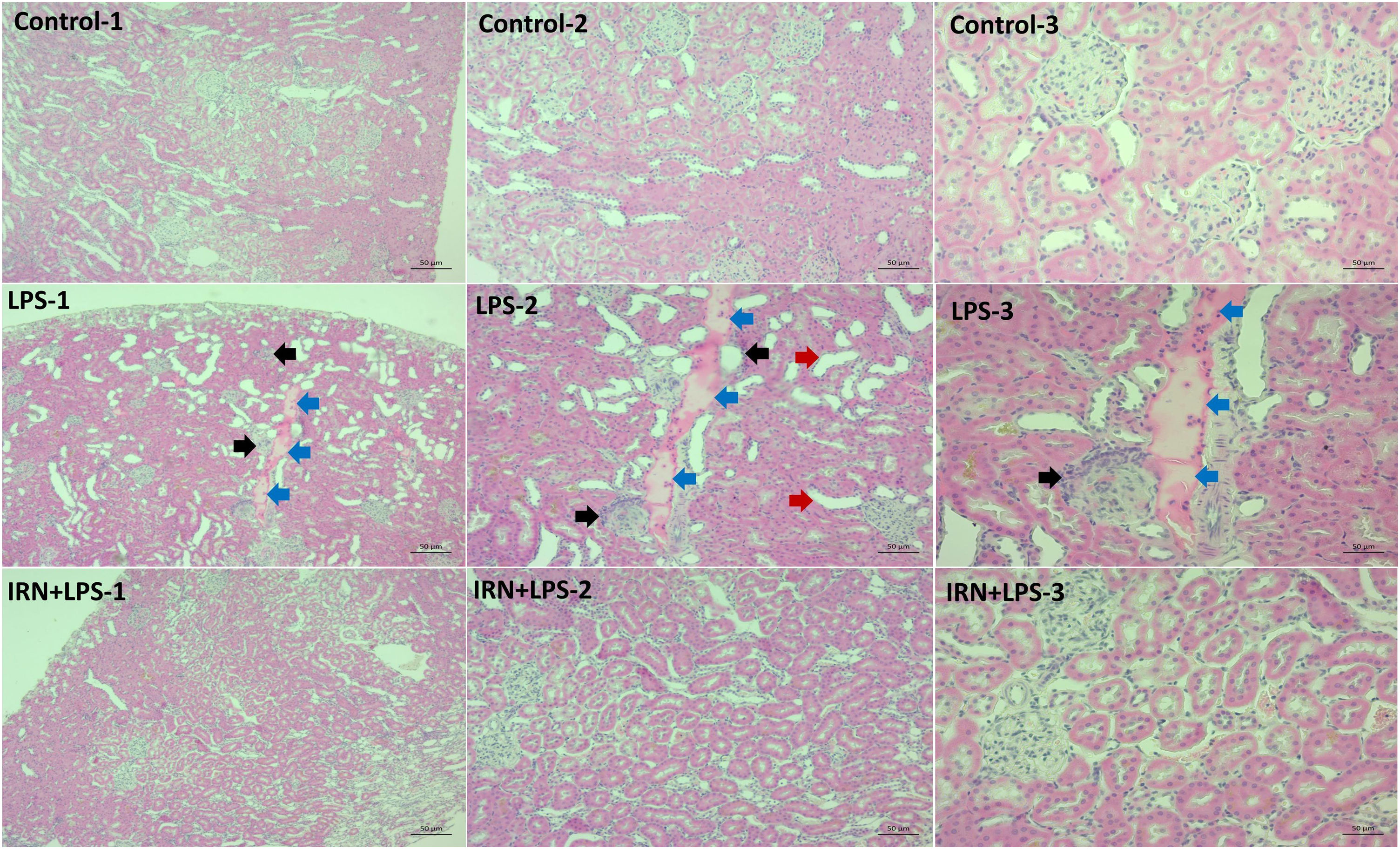 Irbesartan restored aquaporin-1 levels via inhibition of NF-kB ...