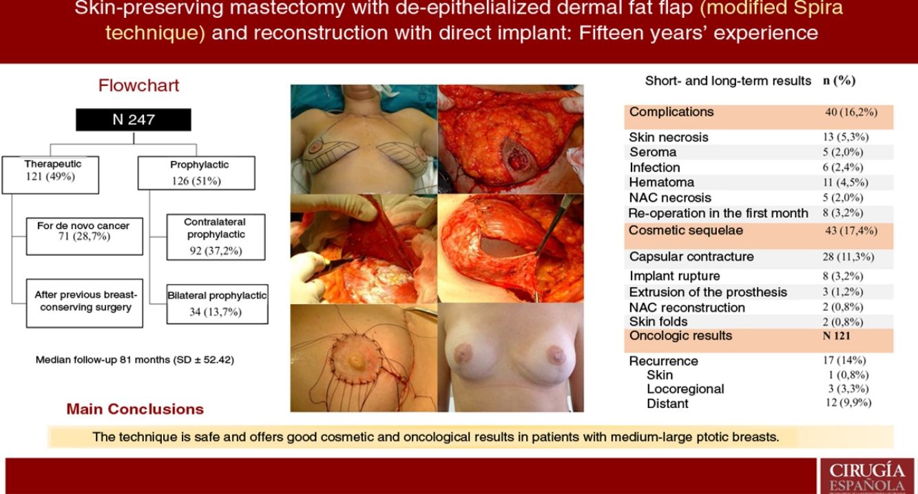 double mastectomy without implants