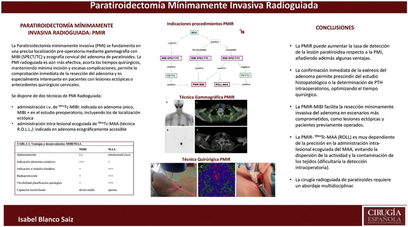 Radio-guided procedure in minimally invasive surgery for primary ...