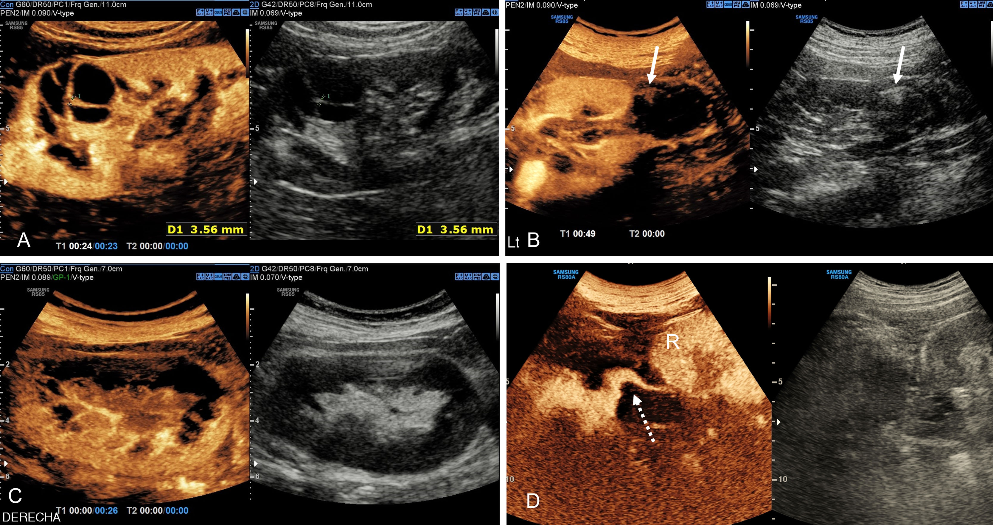 Contrast-enhanced ultrasound fundamentals: the pharmacodynamics and ...