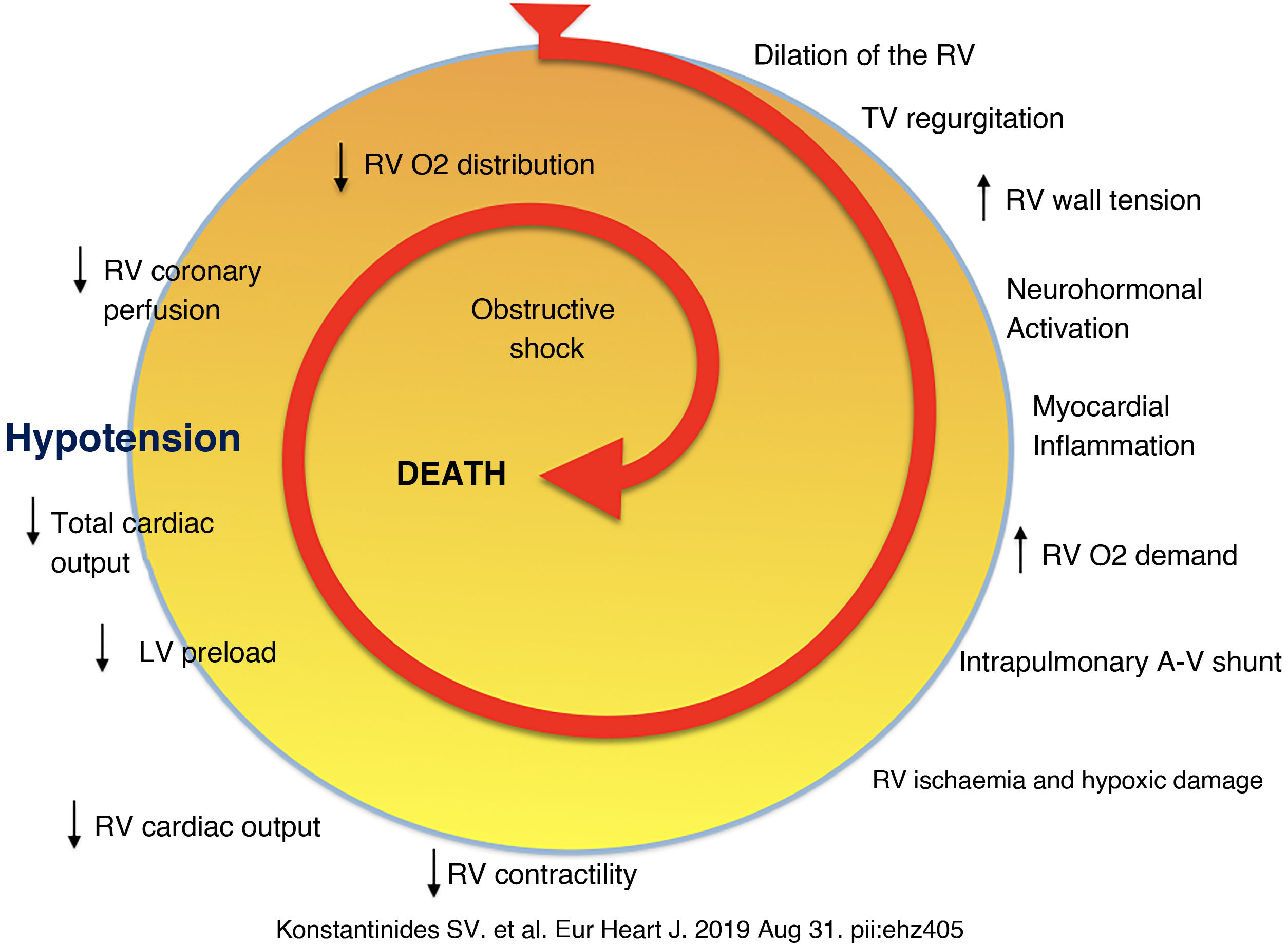 Current state of the interventional approach to acute pulmonary ...