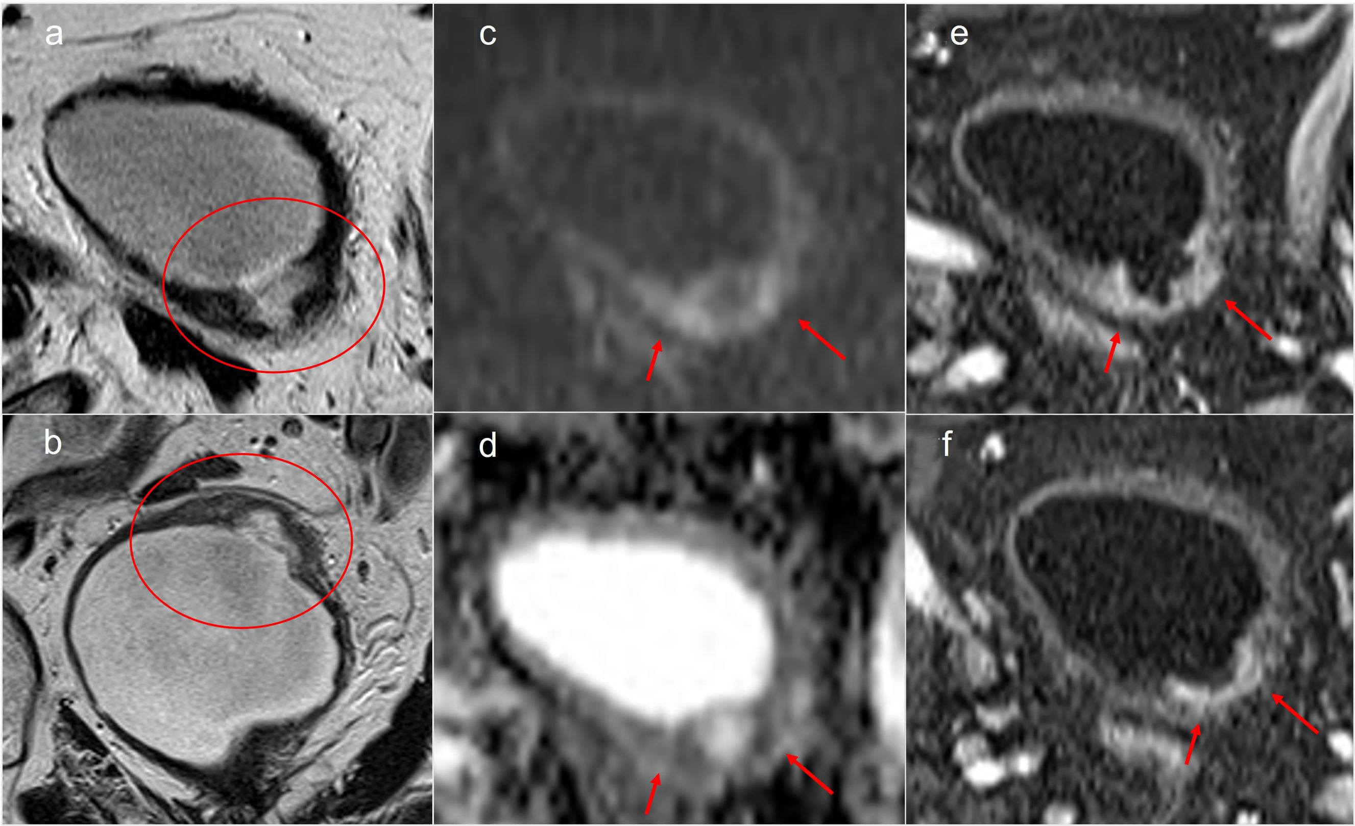 Clinical applications of bladder magnetic resonance imaging: Beyond the ...