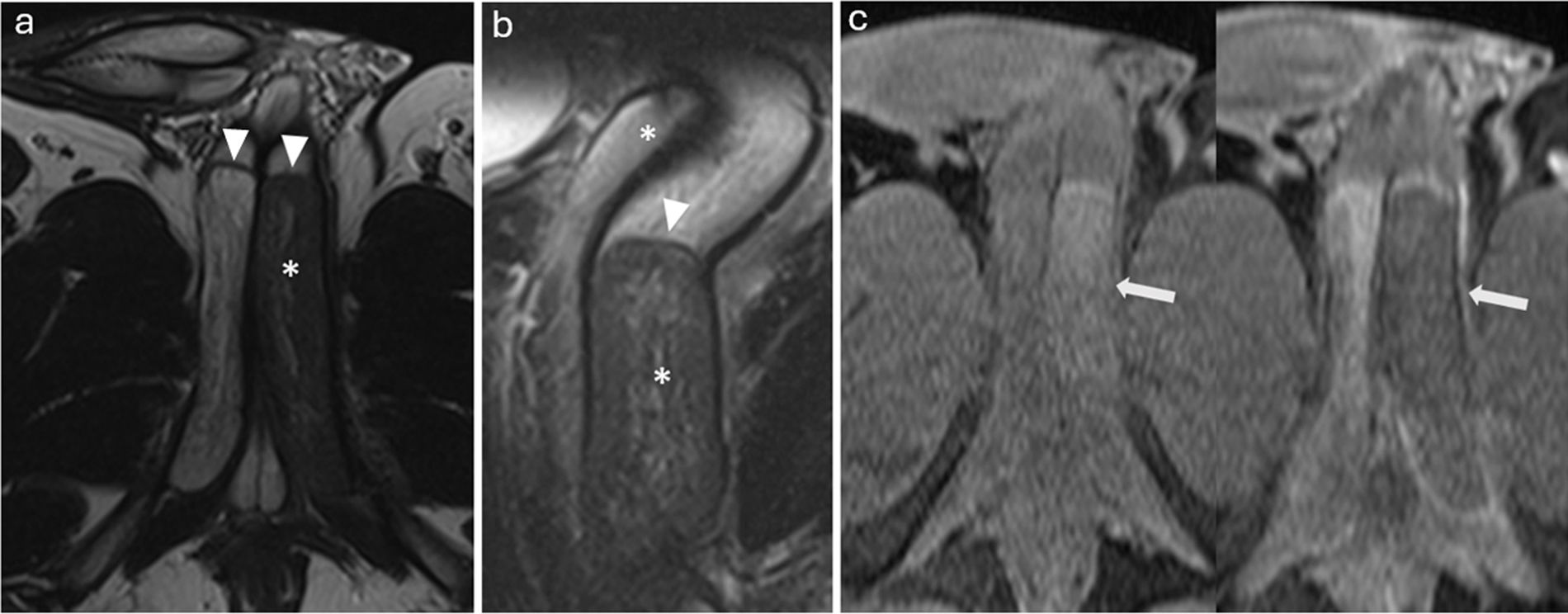 Decoding penile pathology and imaging techniques | Radiología (English ...