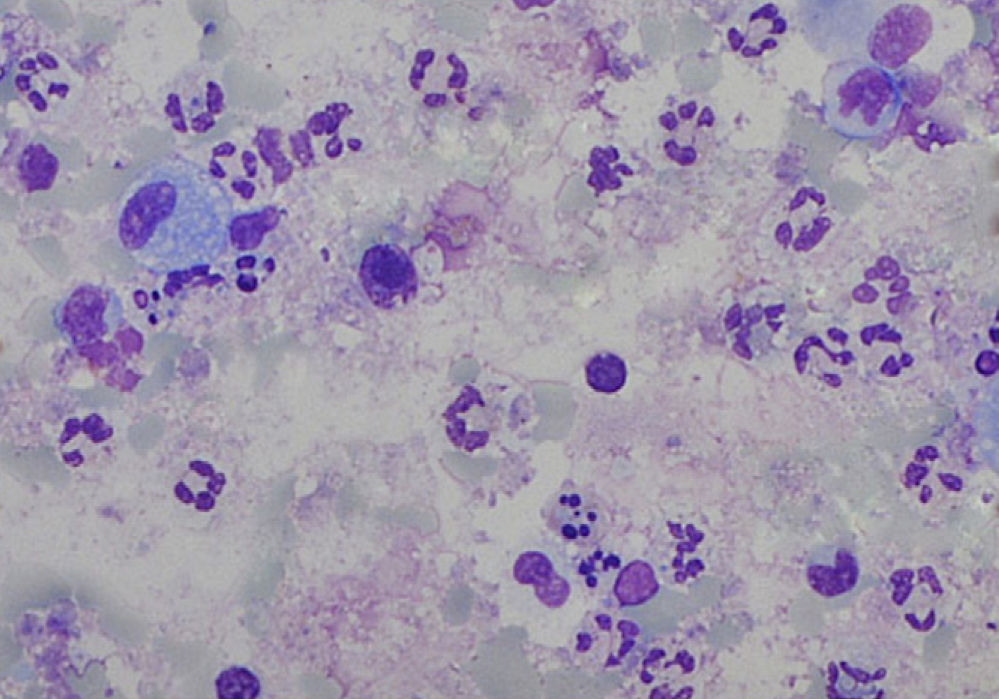 sputum smear