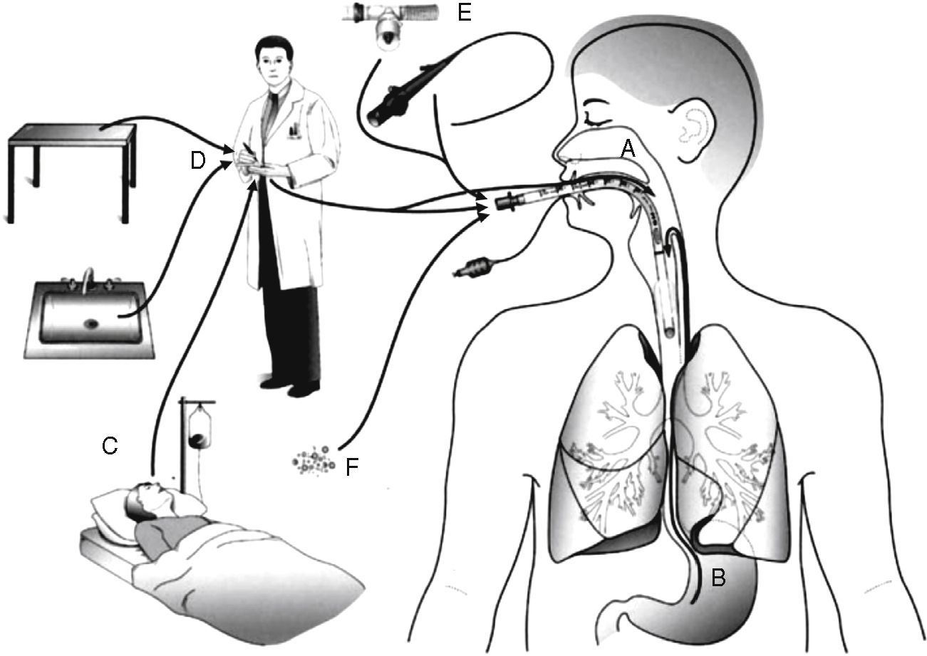ventilator pneumonia