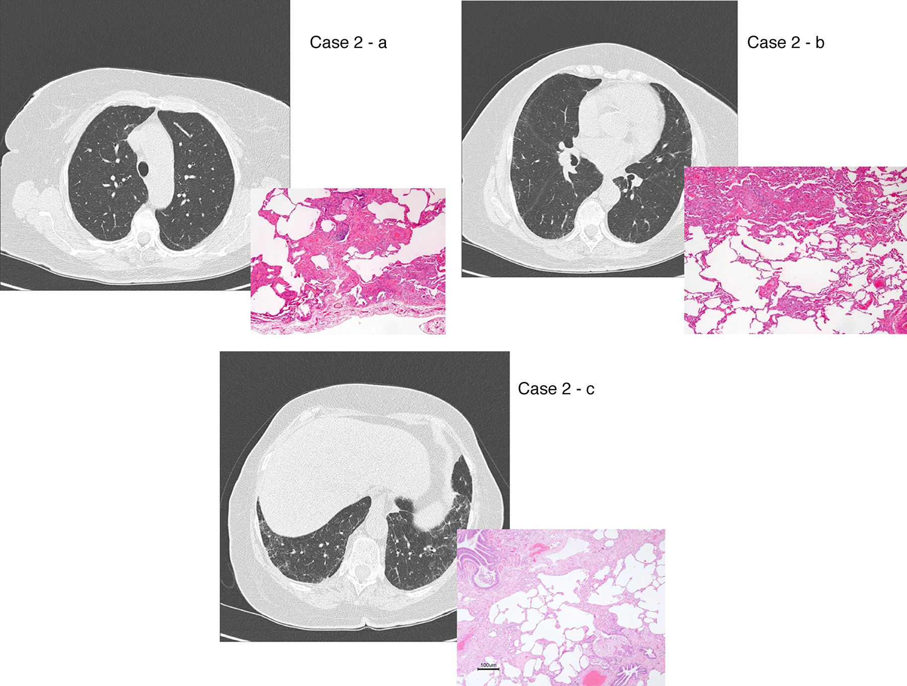 Consensus document for the diagnosis and treatment of idiopathic ...