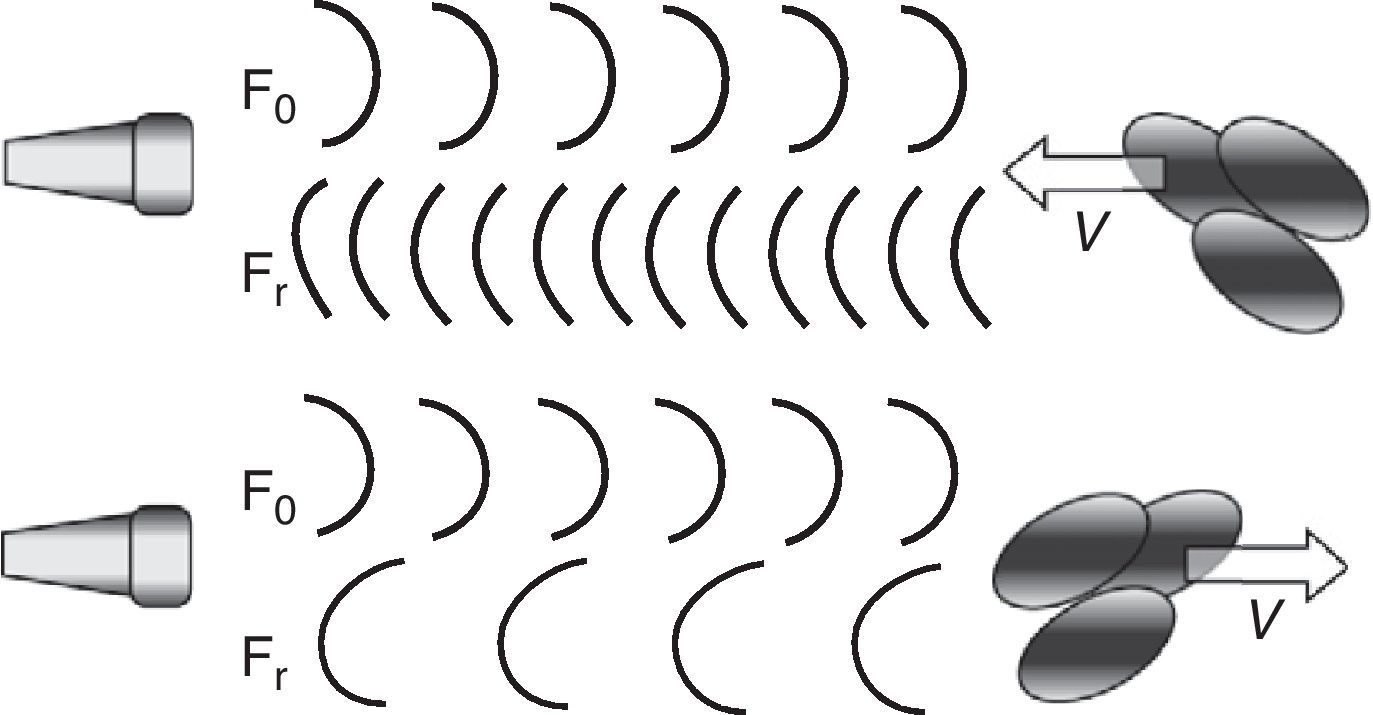 Estimating cardiac output. Utility in the clinical practice. Available ...