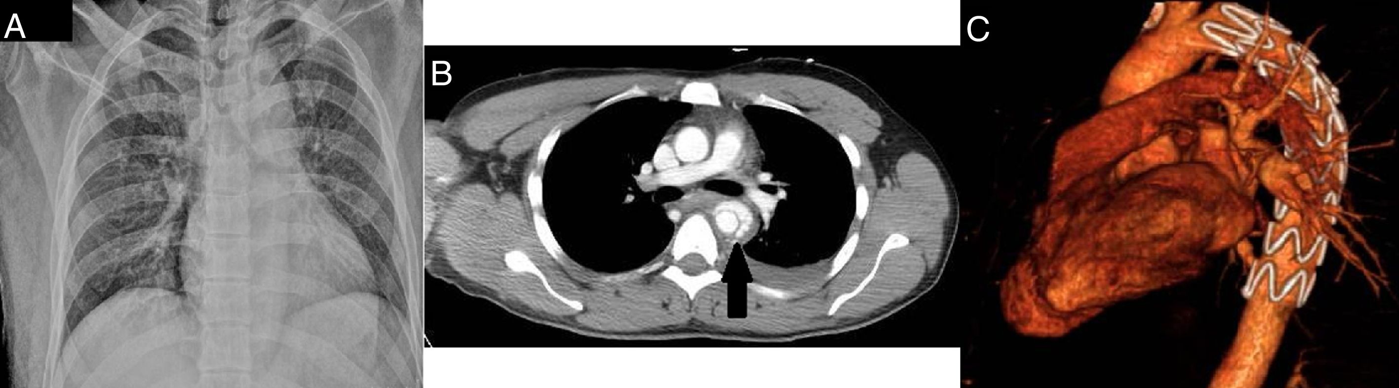 Which multi-trauma patients benefit from performing a total-body CT ...