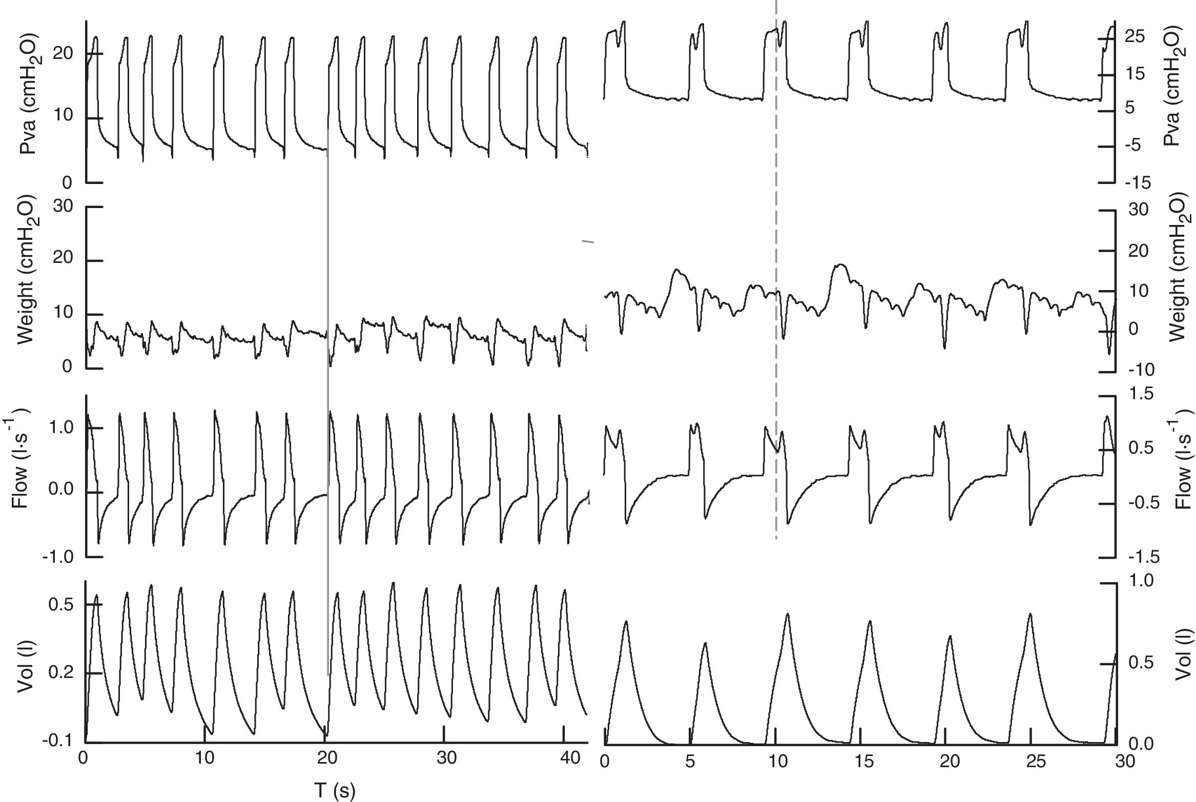 Trigger reverse identification in critical care setting | Medicina ...