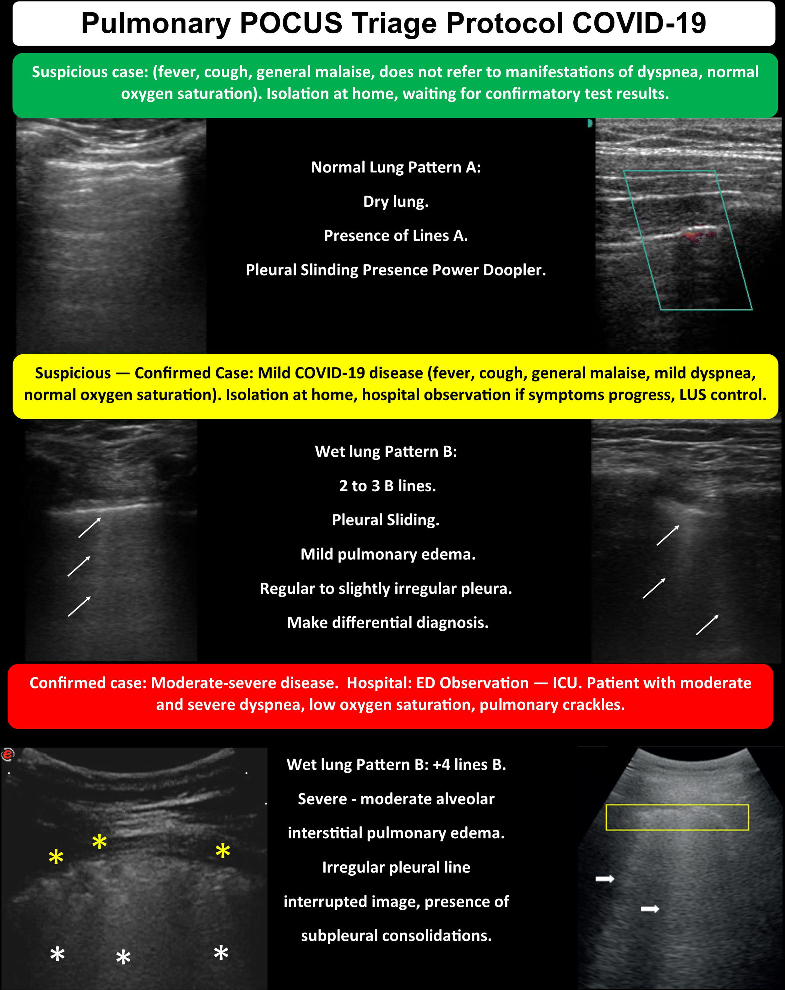 lung sliding pocus