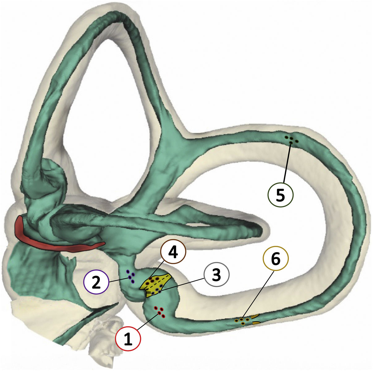 Variants of posterior semicircular canal involvement in benign ...