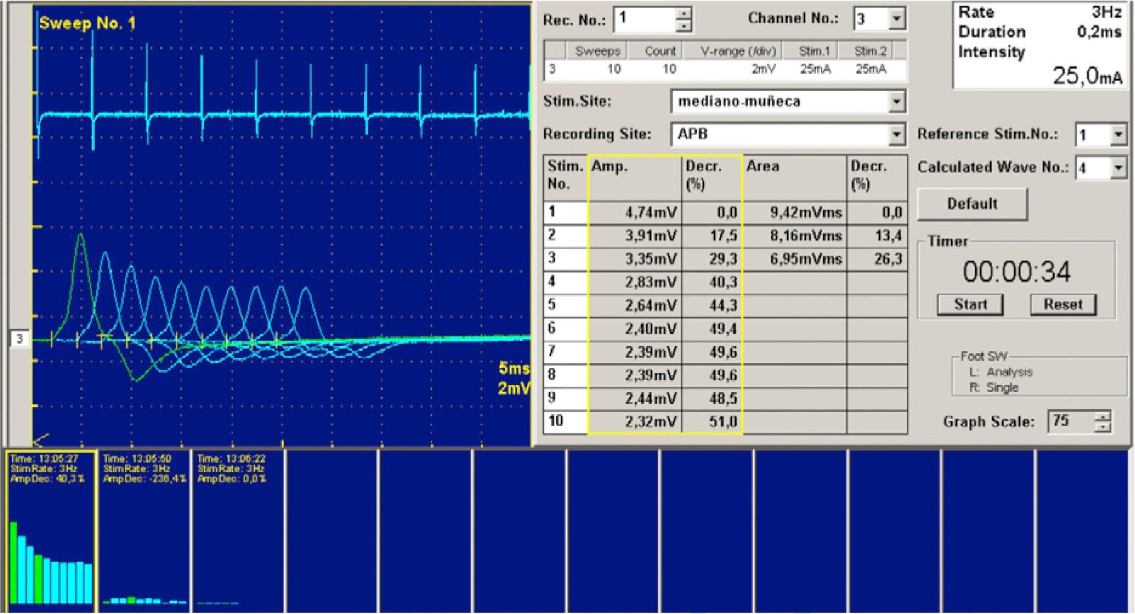 Use of Electromyography in the Diagnosis of Inflammatory Myopathies ...