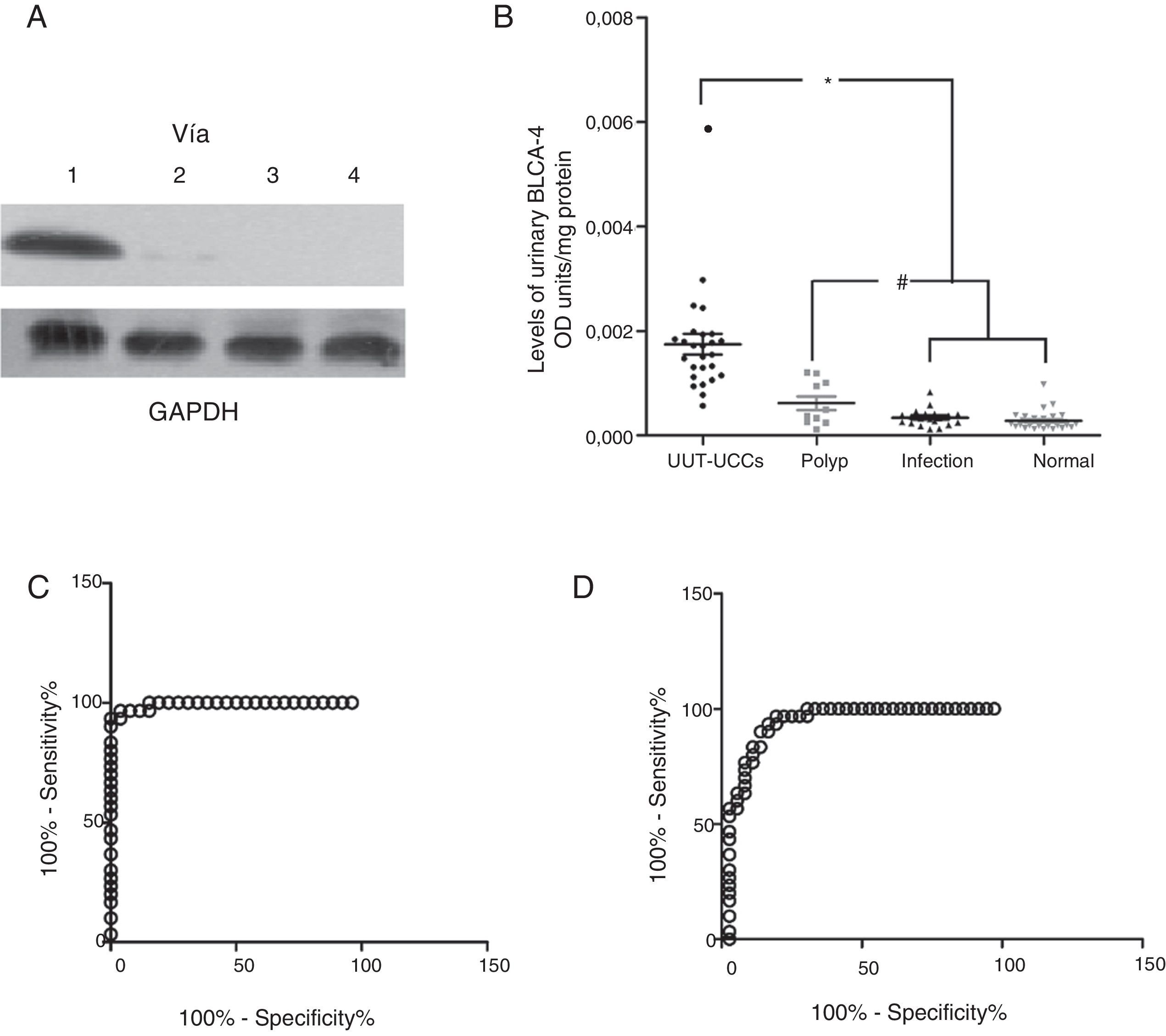 Urinary BLCA-4 level is useful to detect upper urinary tract urothelial ...