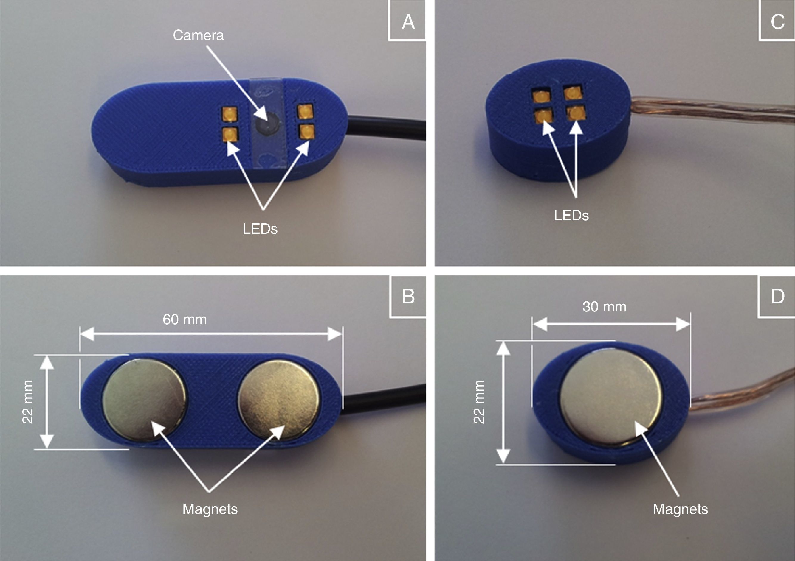 Global vision system in laparoscopy | Actas Urológicas Españolas ...