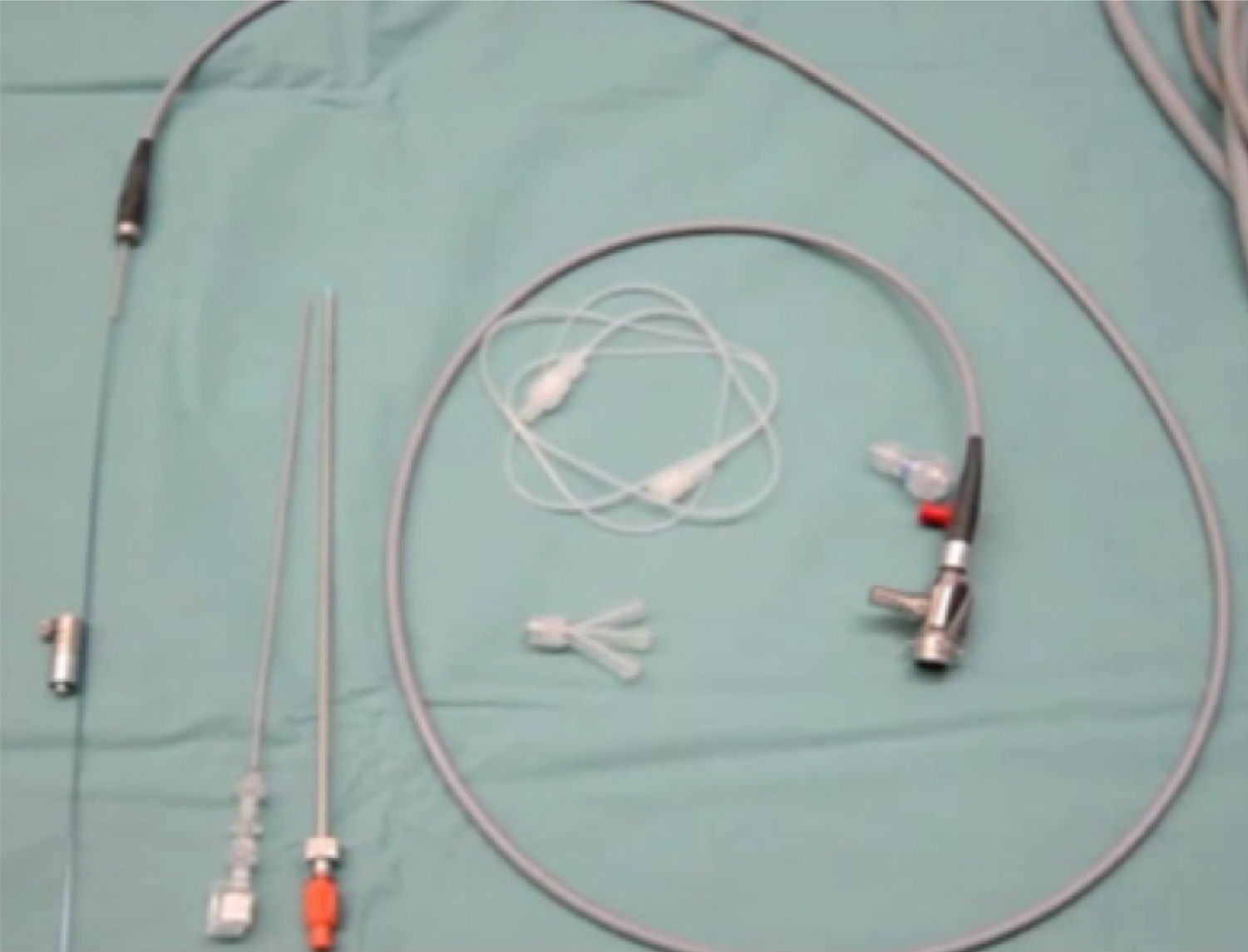 Small-caliber percutaneous nephrolithotomy (SC-PCNL). Therapeutic ...