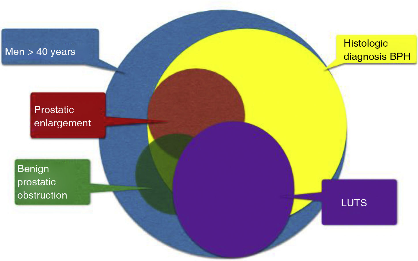 Towards a change of model in the management of benign prostatic ...