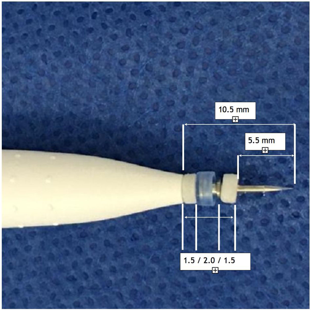 Trocar shortening for pediatric vitreoretinal surgery with a 3D printed ...