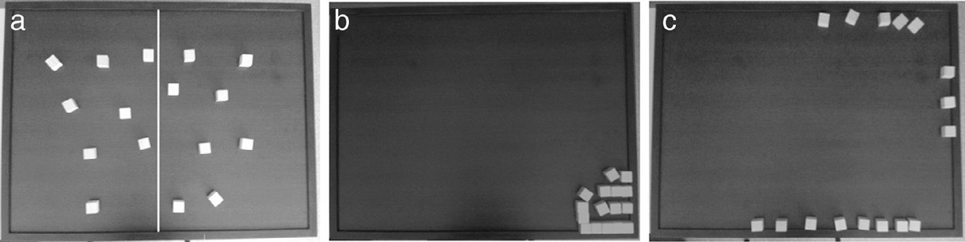 Hemispatial neglect secondary to a traumatic brain injury | Neurología ...