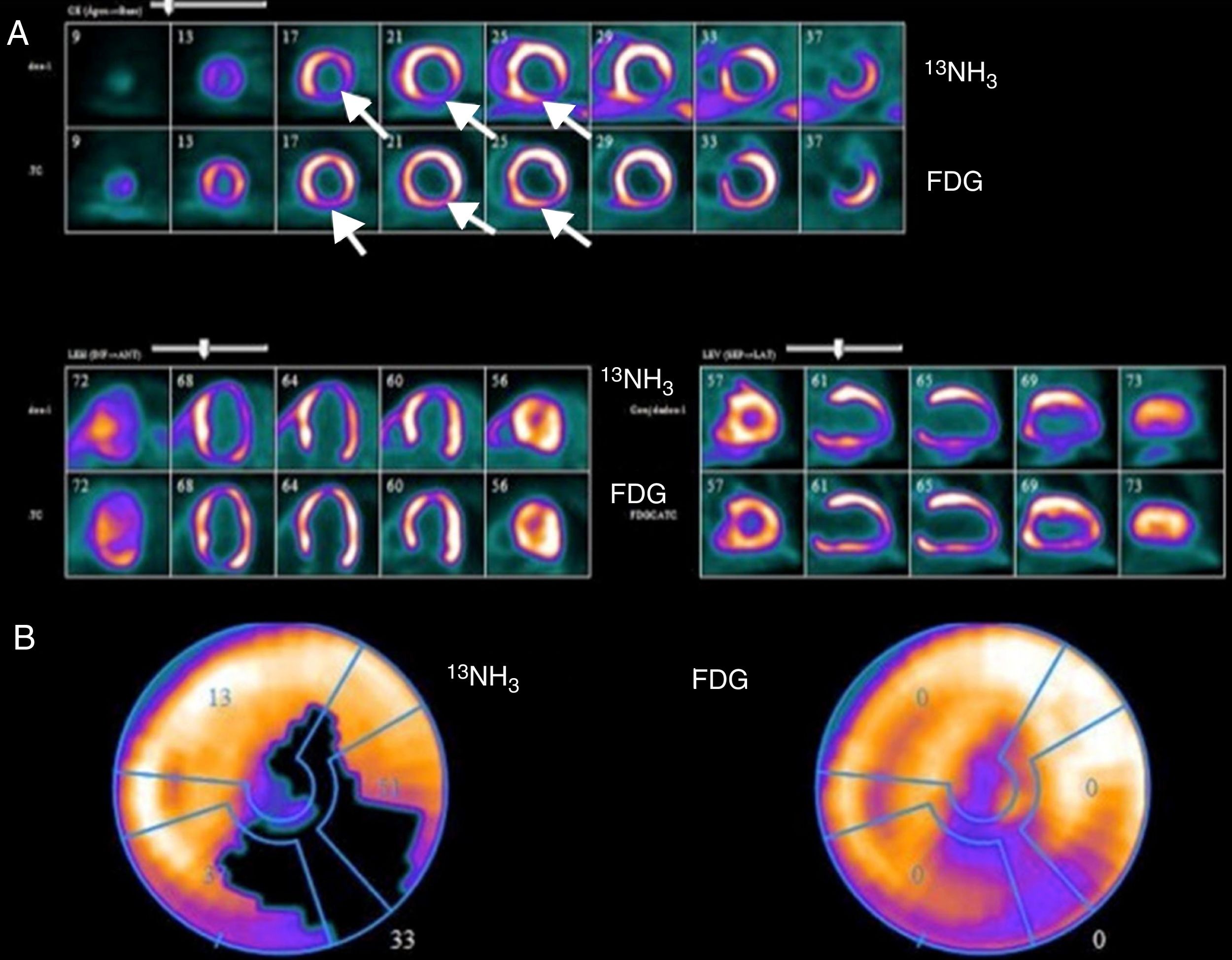 positron emission tomography example