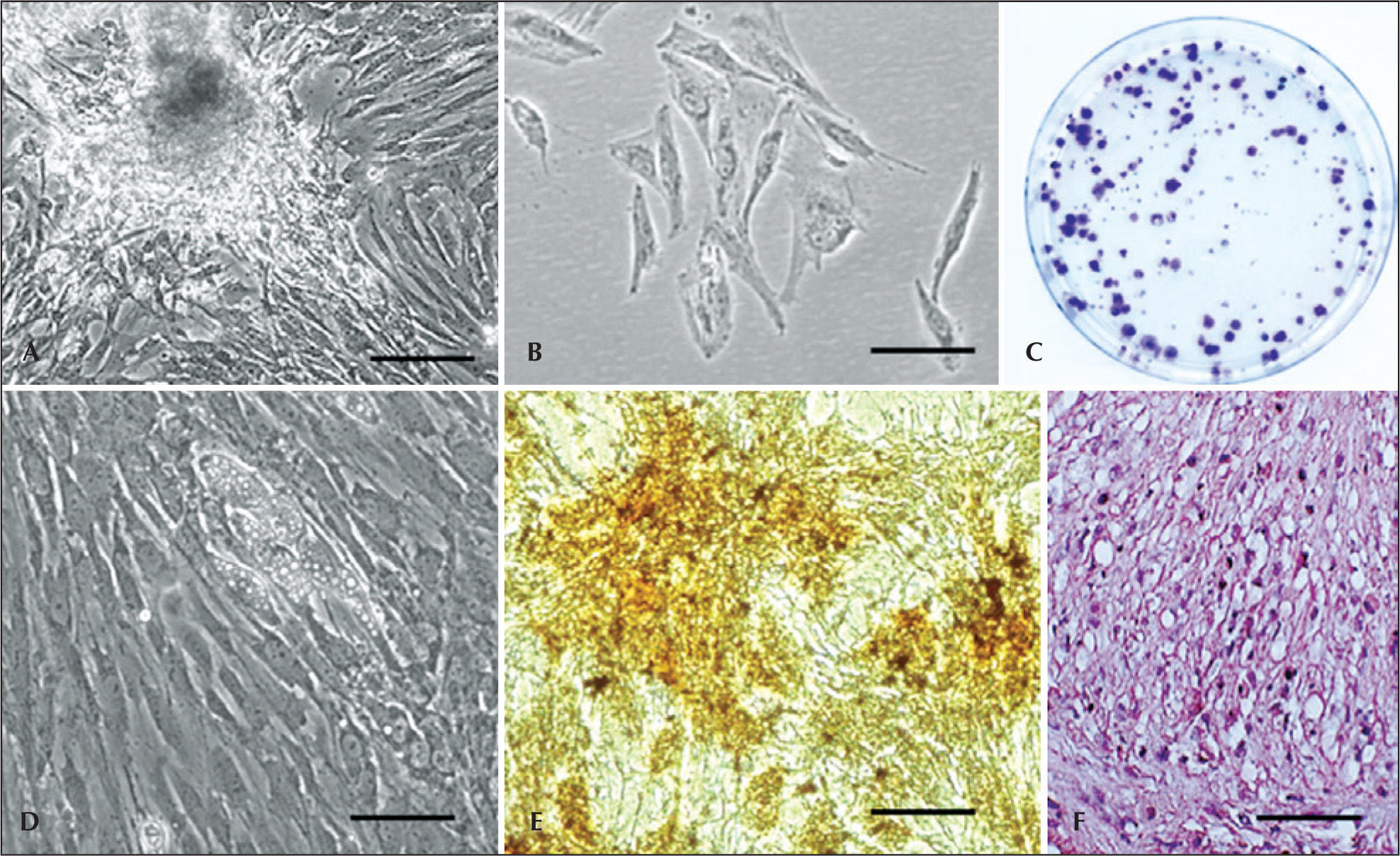 adipose derived stem cells