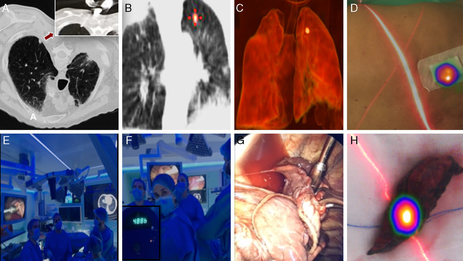 Radioguided surgery and the GOSTT concept: From pre-operative image and ...
