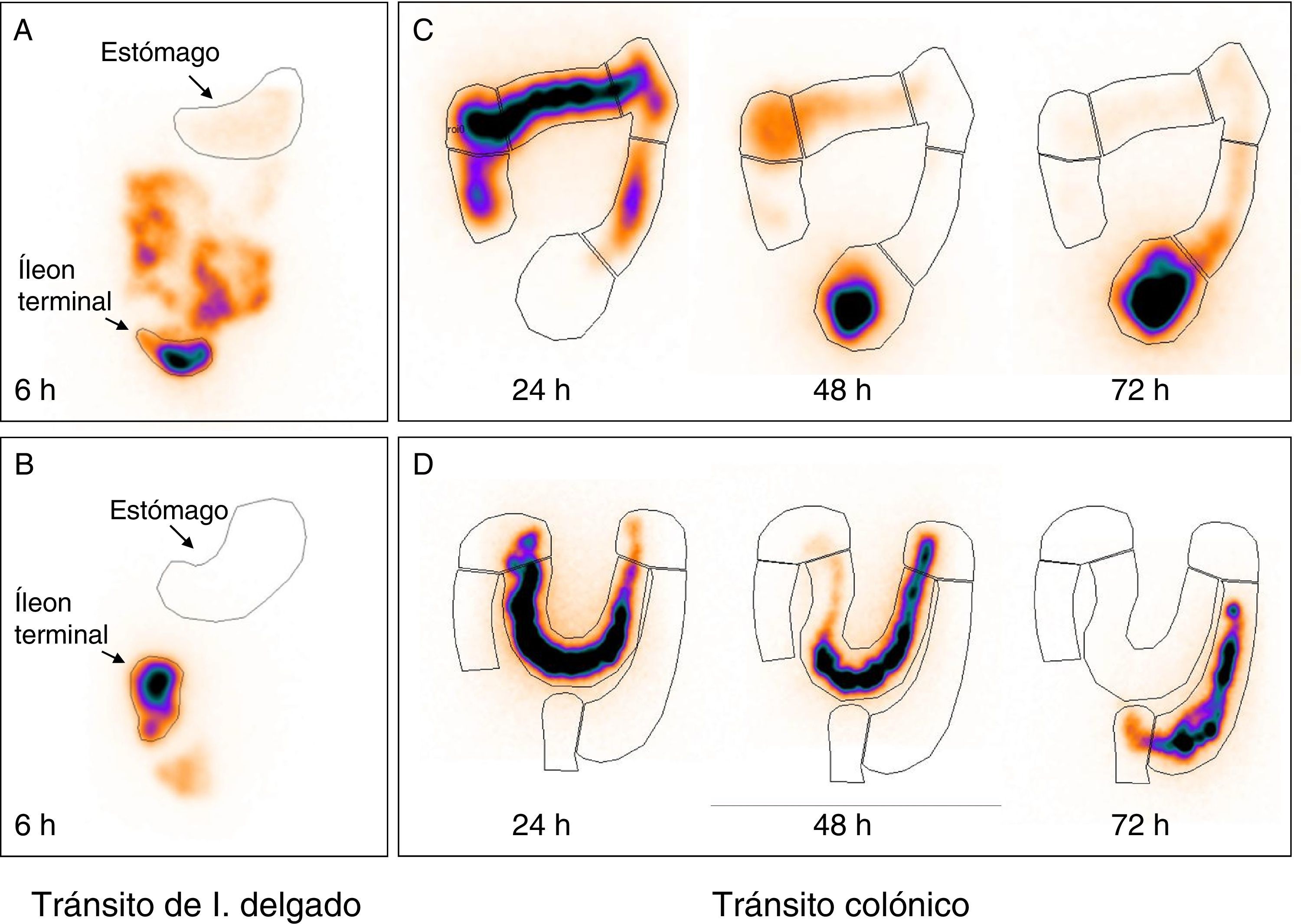Gammagrafía de tránsito gastrointestinal en el estudio del ...