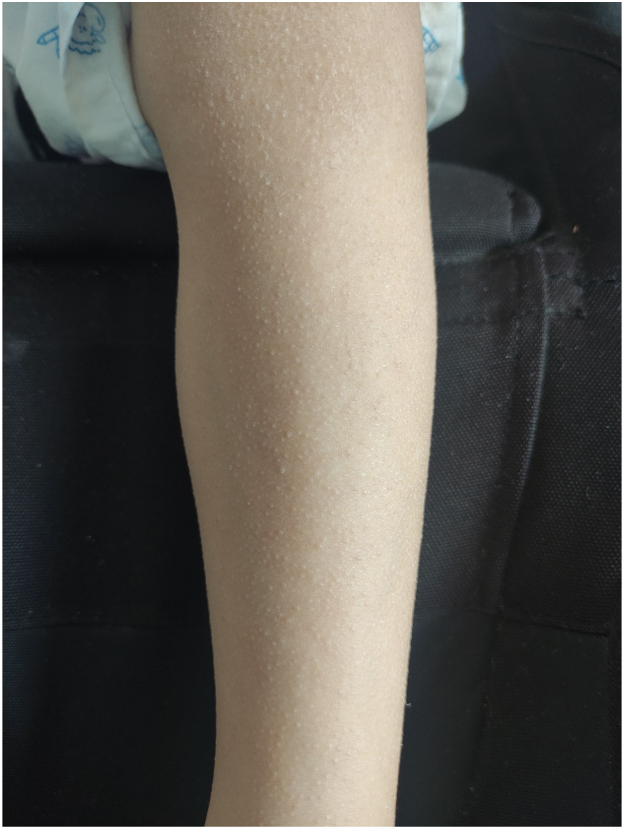 Usefulness of bone gammagraphy as a reflection of the patient’s ...