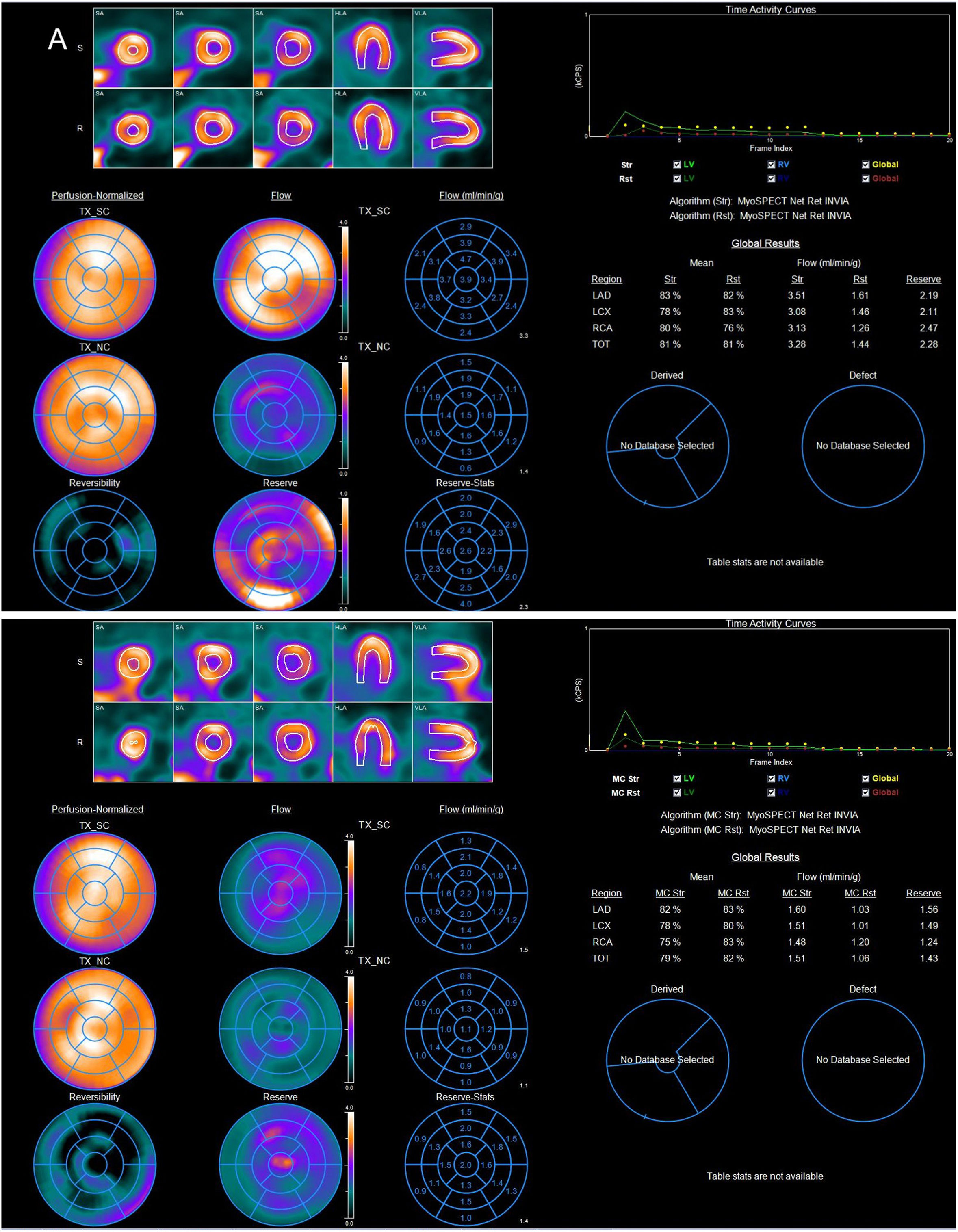 Assessment of absolute myocardial blood flow with a dedicated CZT ...