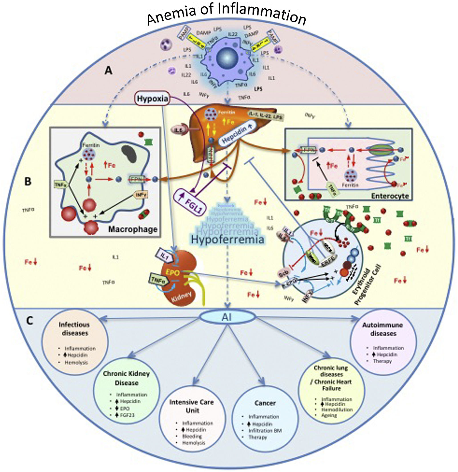 Anemia of inflammation and iron metabolism in chronic diseases ...