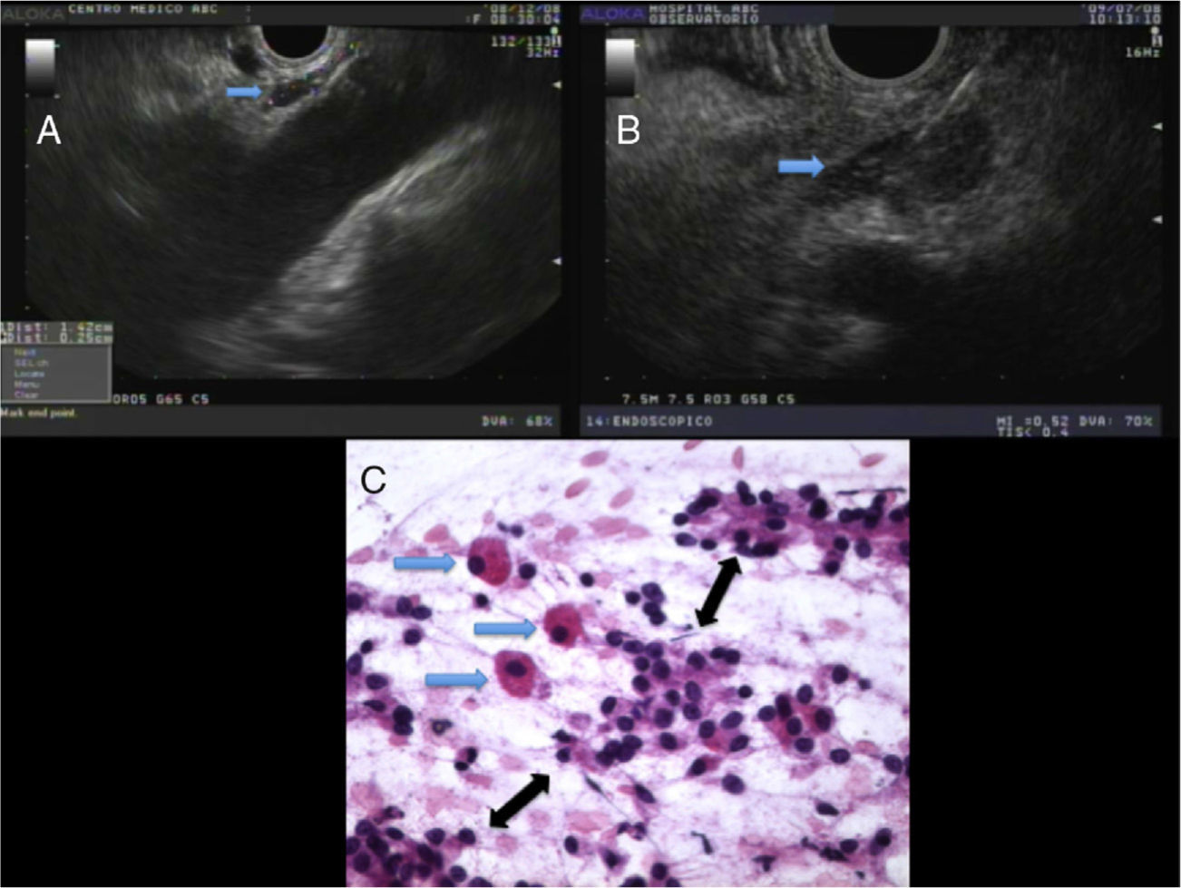 celiac axis lymph nodes