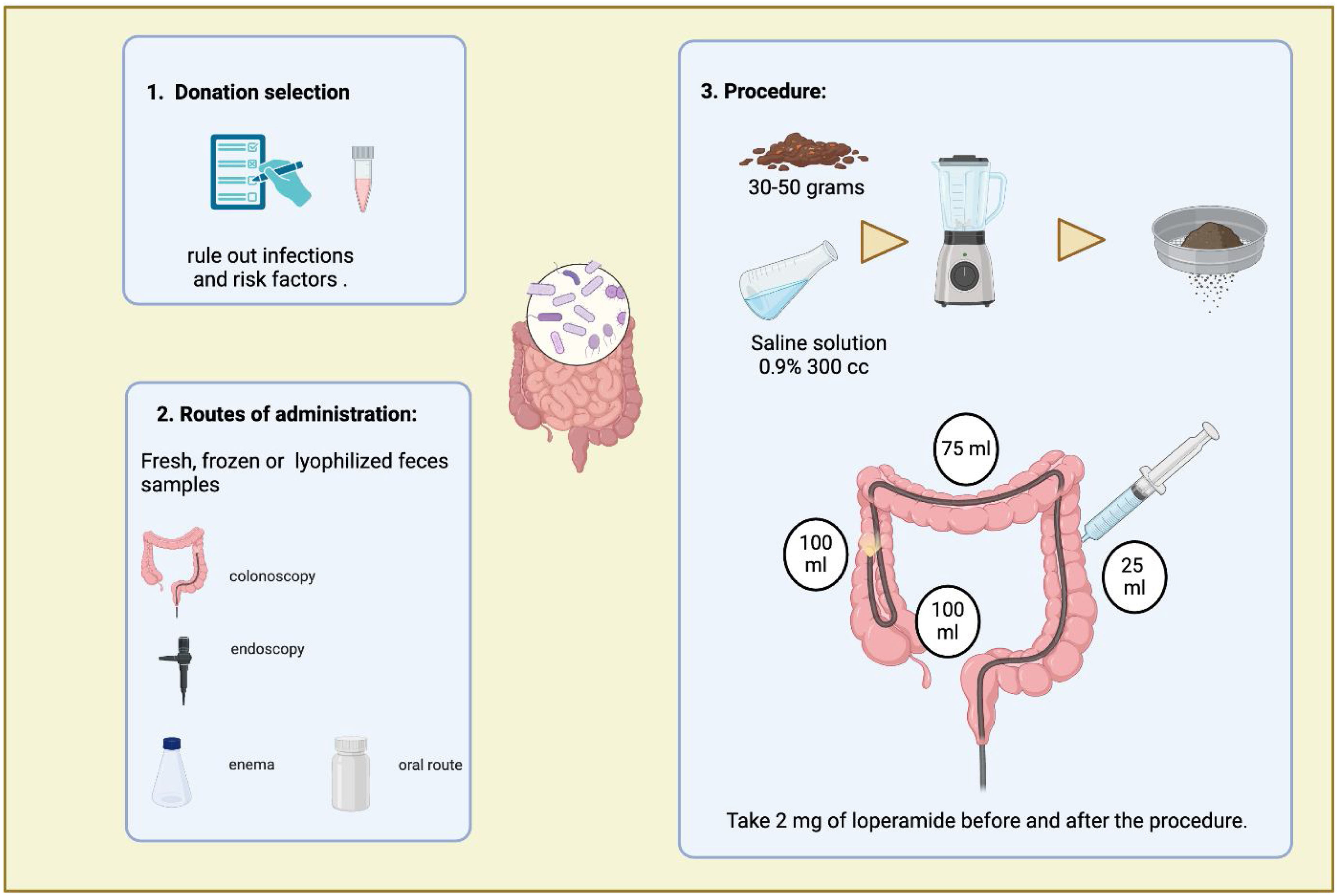 Fecal microbiota transplantation through colonoscopy in the treatment ...