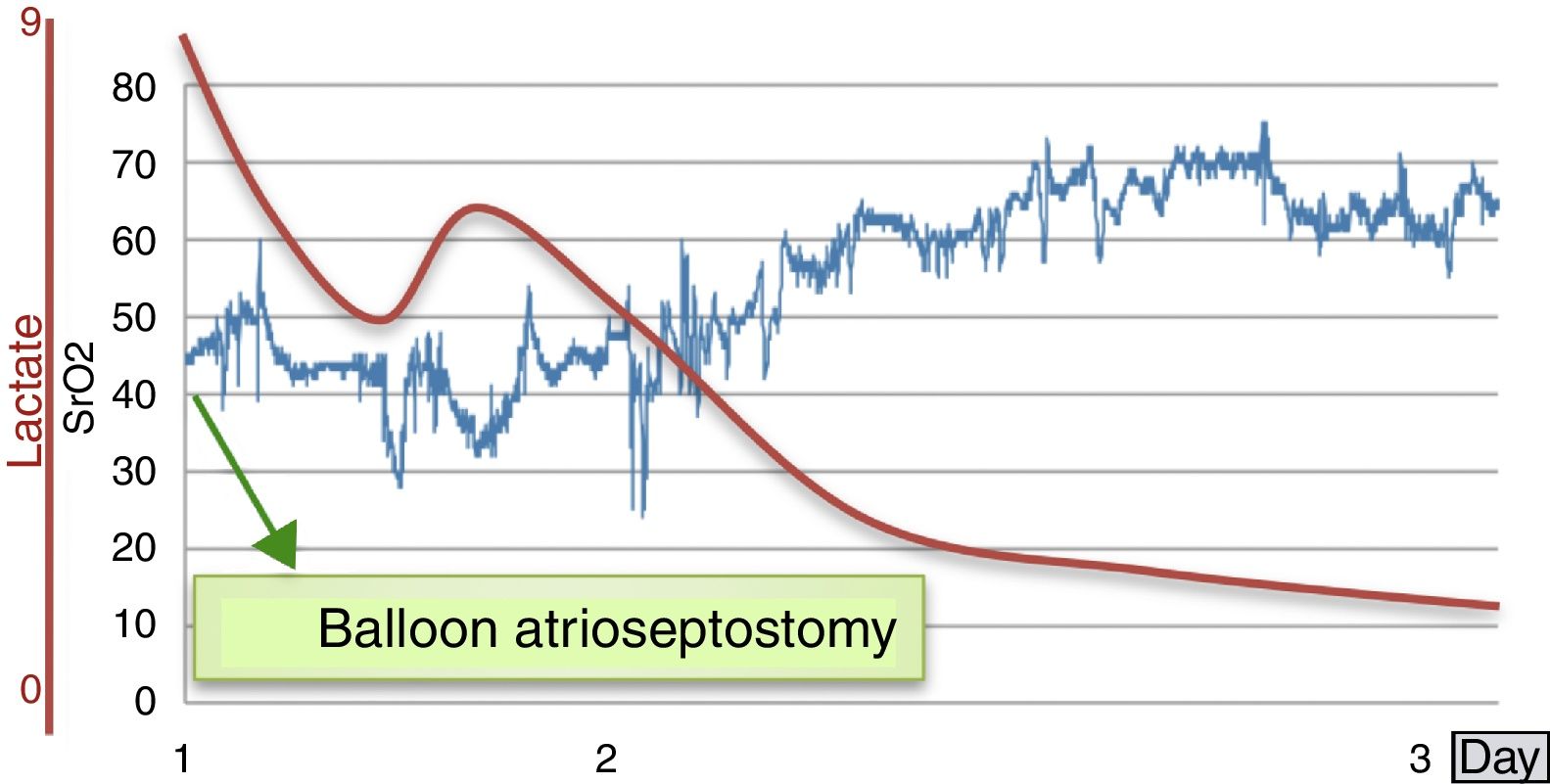 Cerebral oximetry monitoring in the management of severe hypoxaemia associated with ...