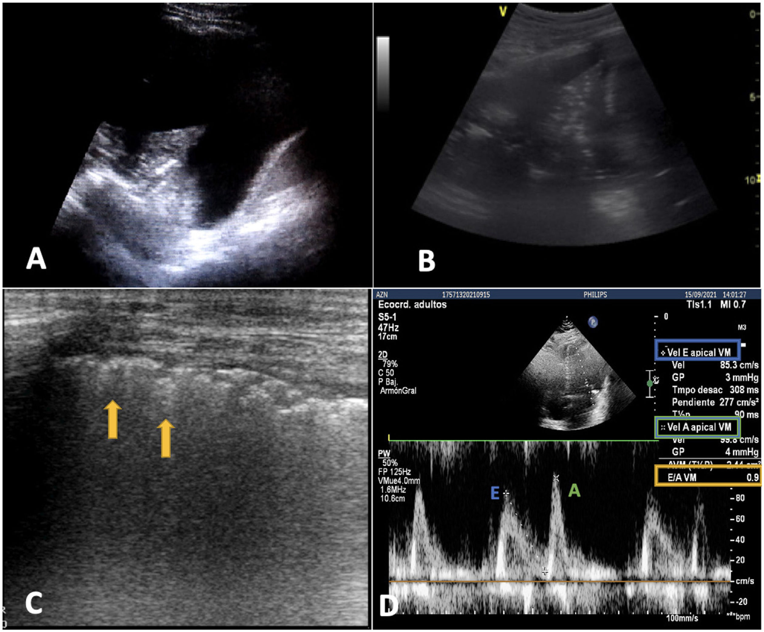 Update on the use of ultrasound in the diagnosis and monitoring of the ...