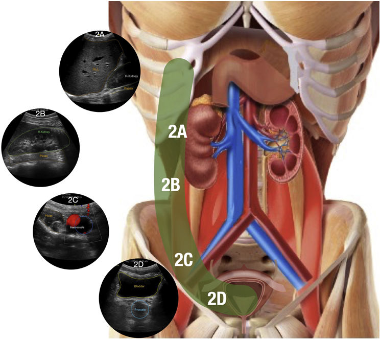 Detecting occult hemorrhage bleeding using a new protocol called the ...