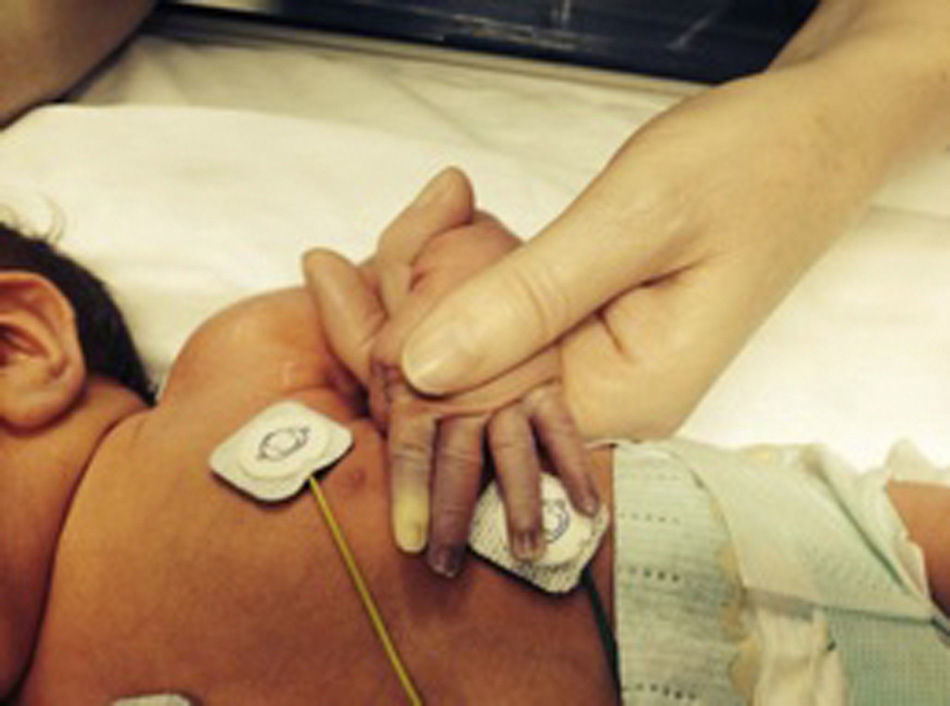 nitroglycerin paste side effects