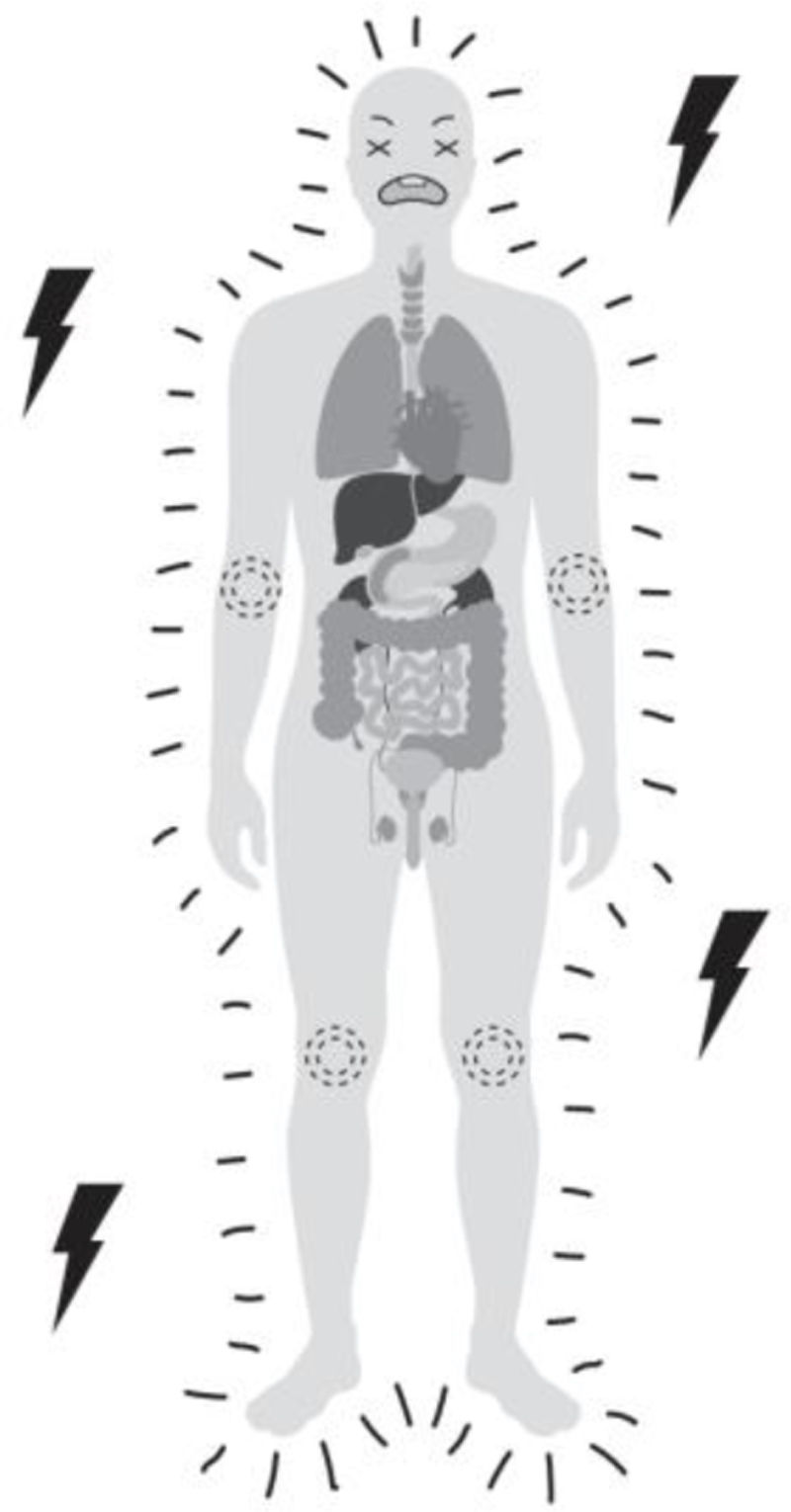 Somatization in childhood and adolescence: a guide to facilitate its ...