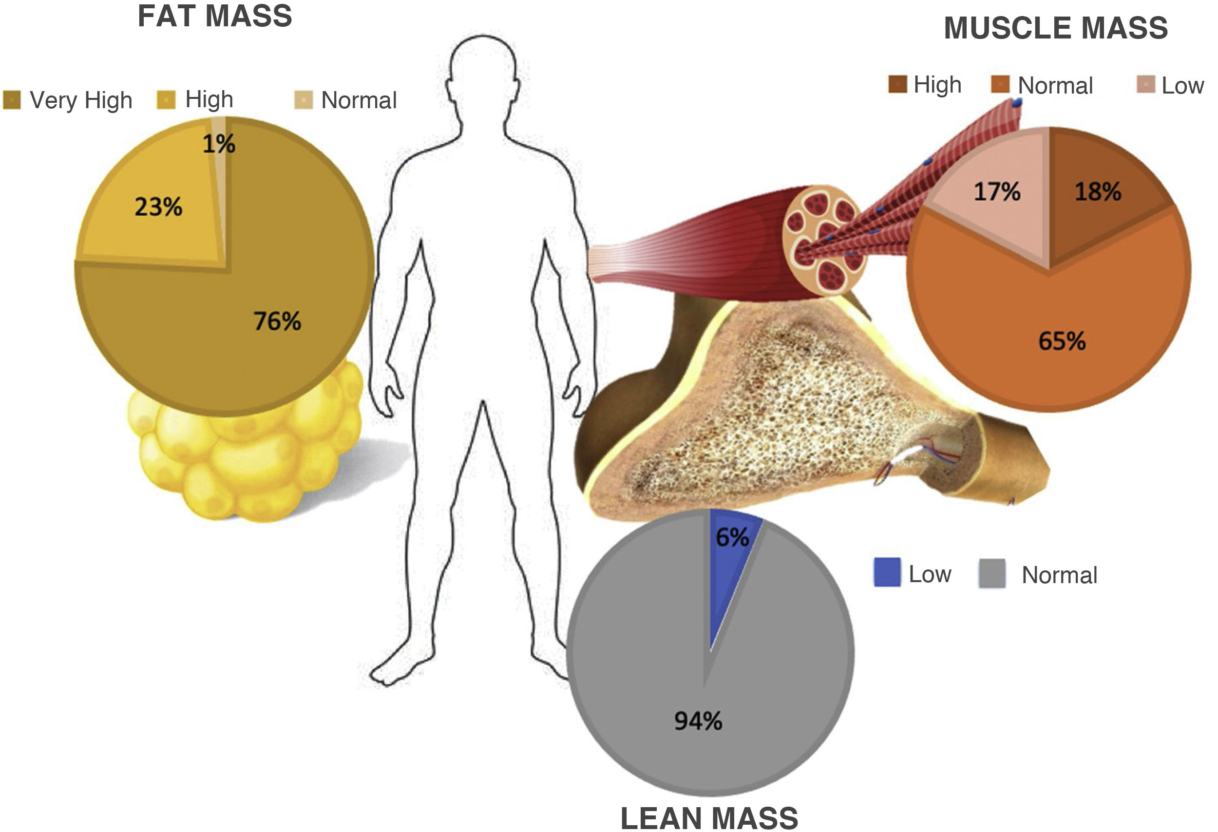 Body composition and phase angle by bioimpedance in patients with MAFLD ...