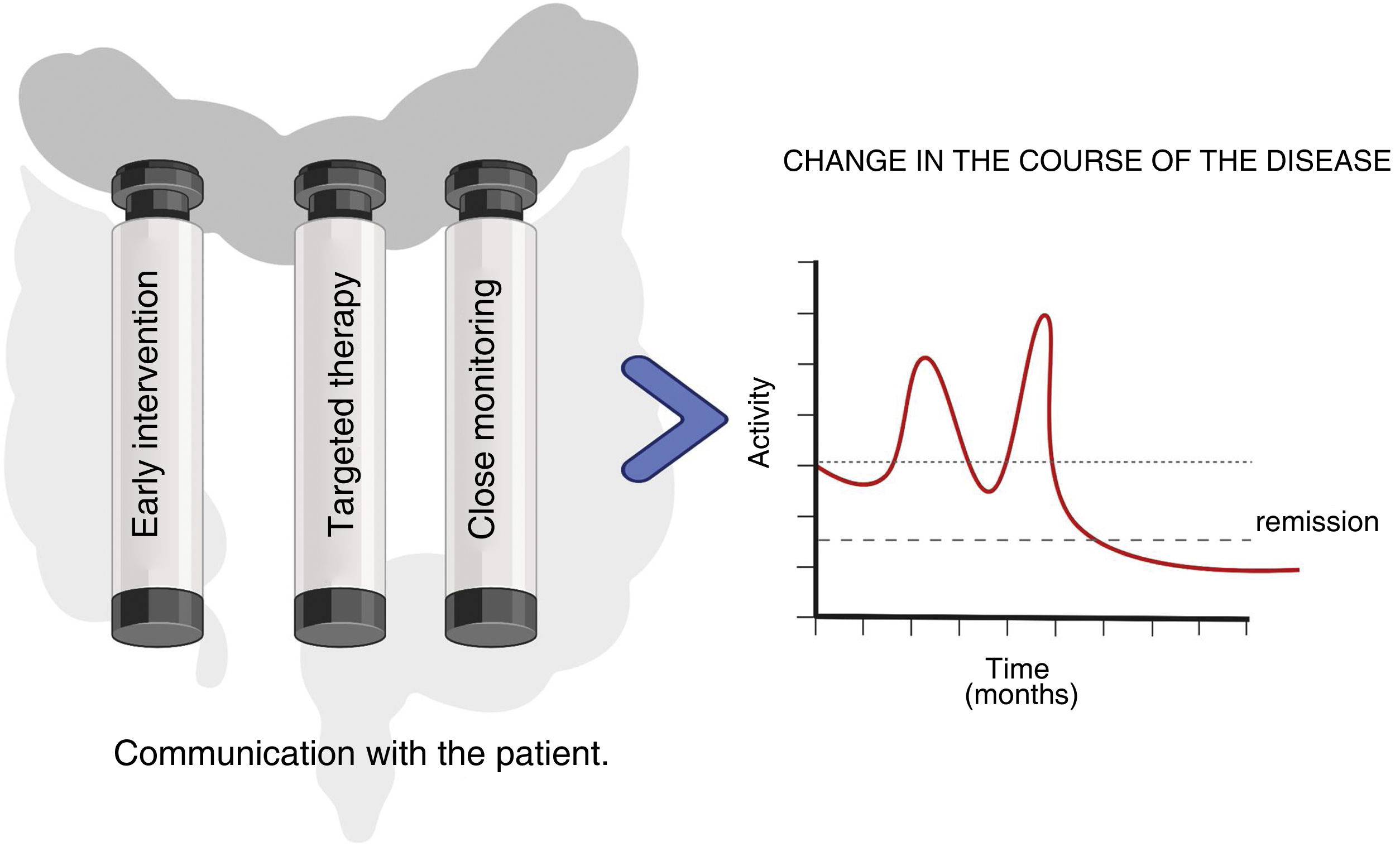 Corticosteroids in inflammatory bowel disease: Are they still a ...