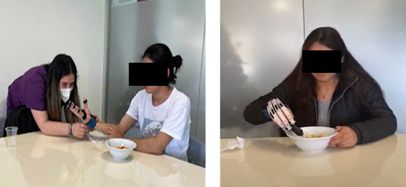 Use of thickened-handled spoon in improving feeding performance in ...