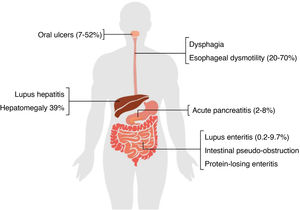 A practical perspective on gastrointestinal manifestations of systemic ...
