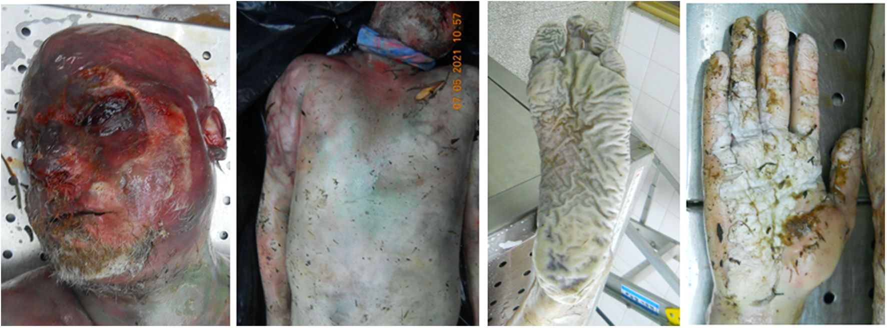 drowned human corpse