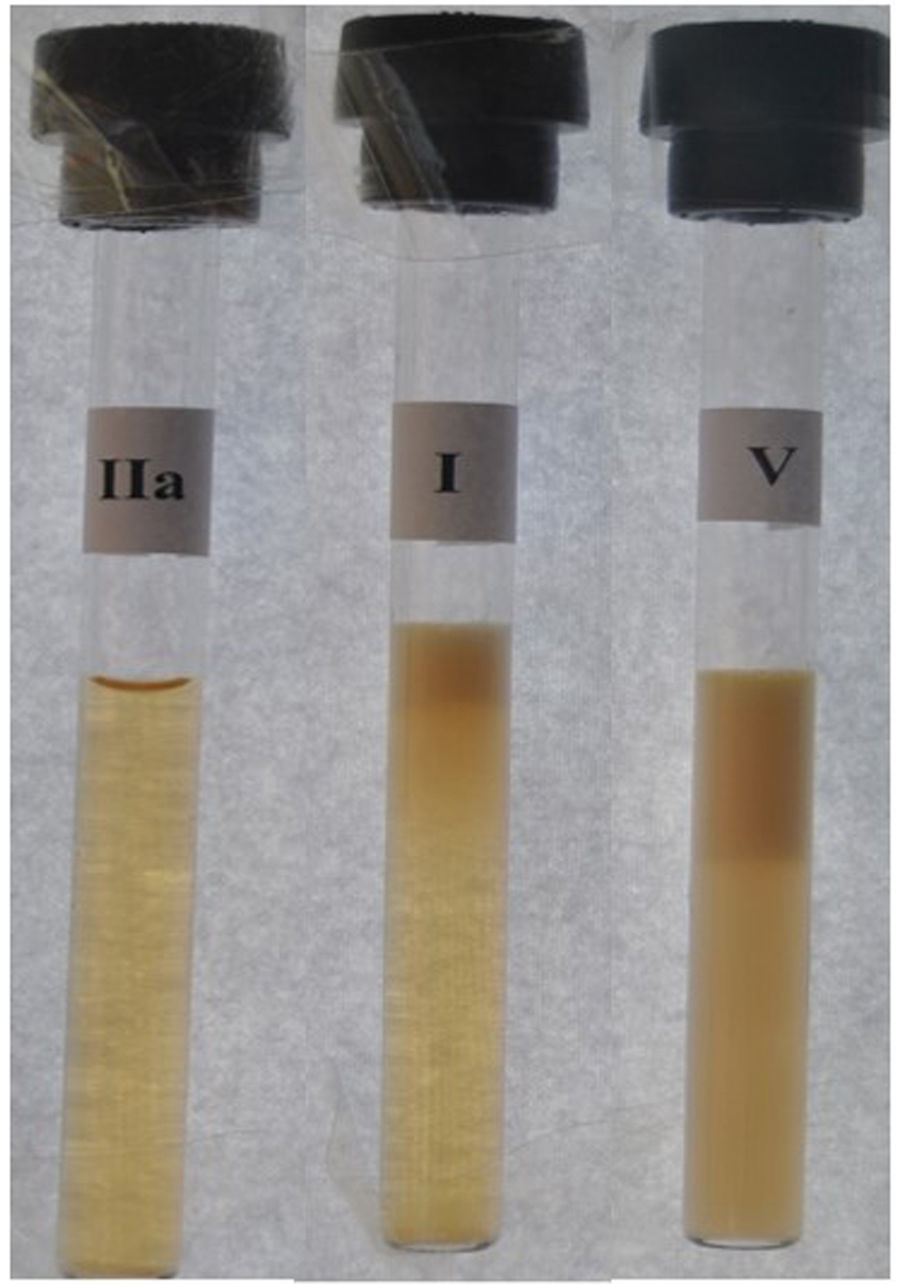 Multifactorial chylomicronemia: Keys to detecting severe forms ...