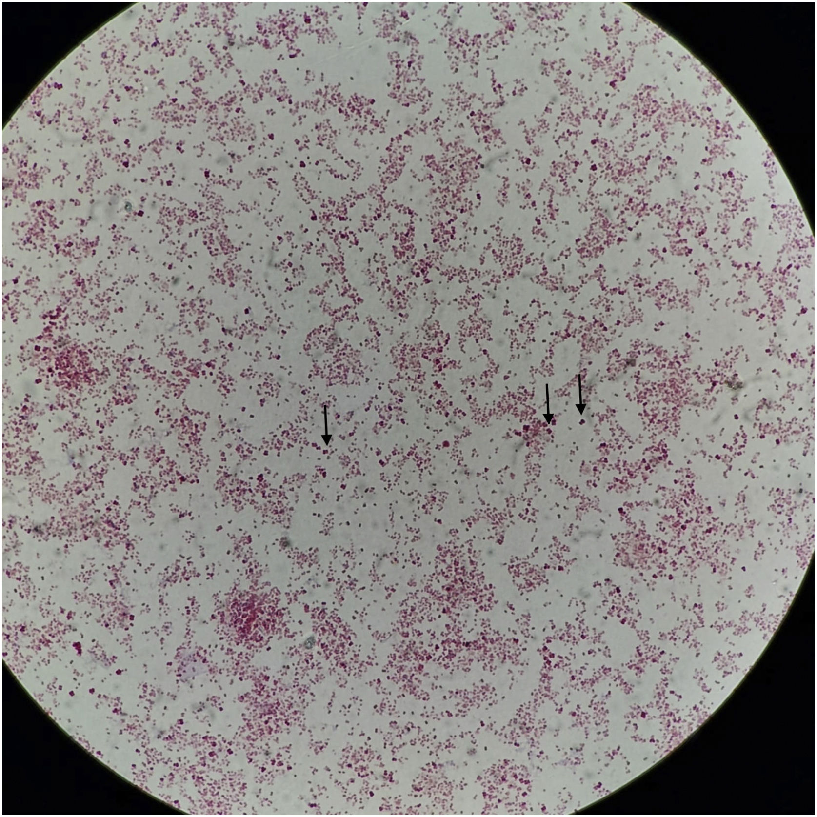 gram negative diplococci std